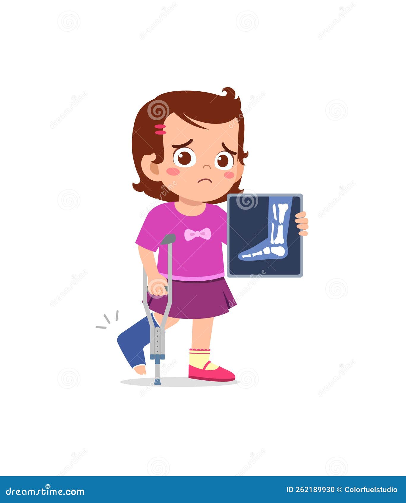Little Kid Got Accident and Got Bone Fracture Stock Vector ...