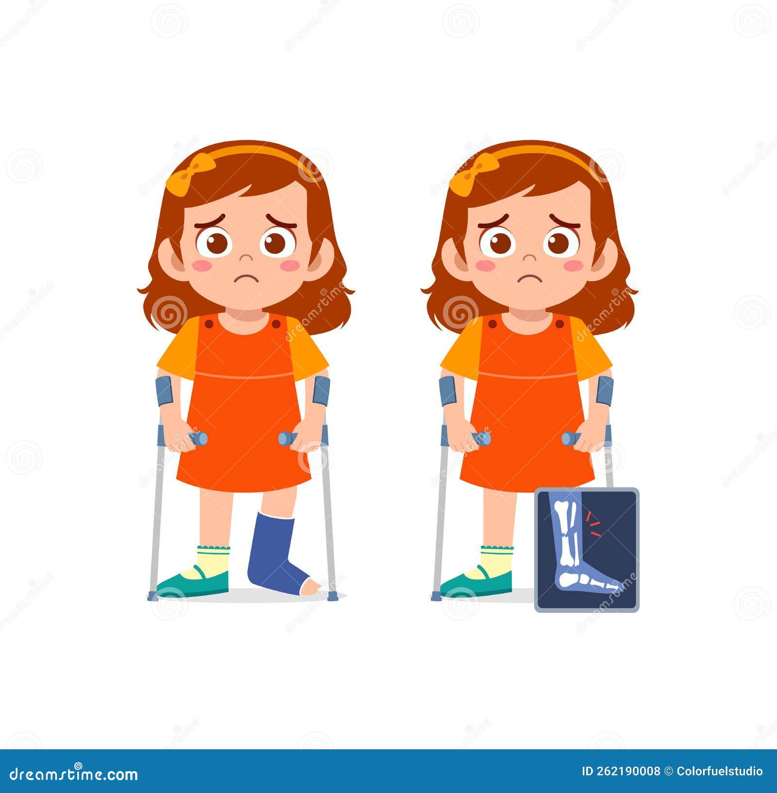 Little Kid Got Accident and Got Bone Fracture Stock Illustration ...