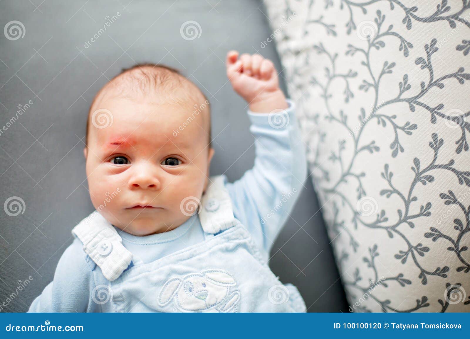 Little Newborn Baby with Little Wound on His Forehead Stock Photo ...