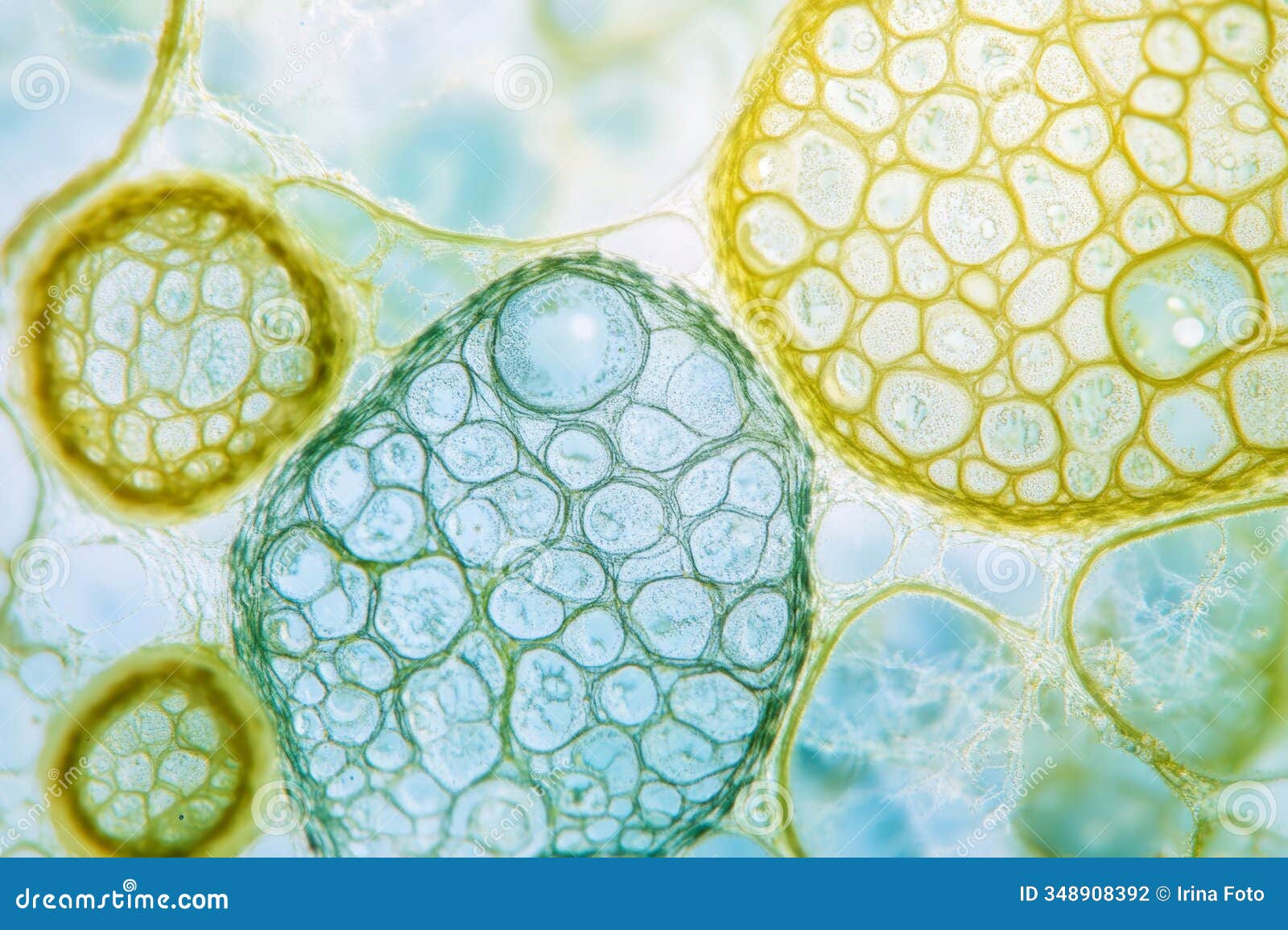 Live Chlamydocapsa Sp Cells Observed Under a Microscope Highlighting ...