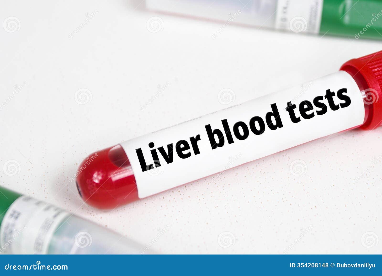 Liver. Blood Vessels Royalty-Free Stock Image | CartoonDealer.com ...