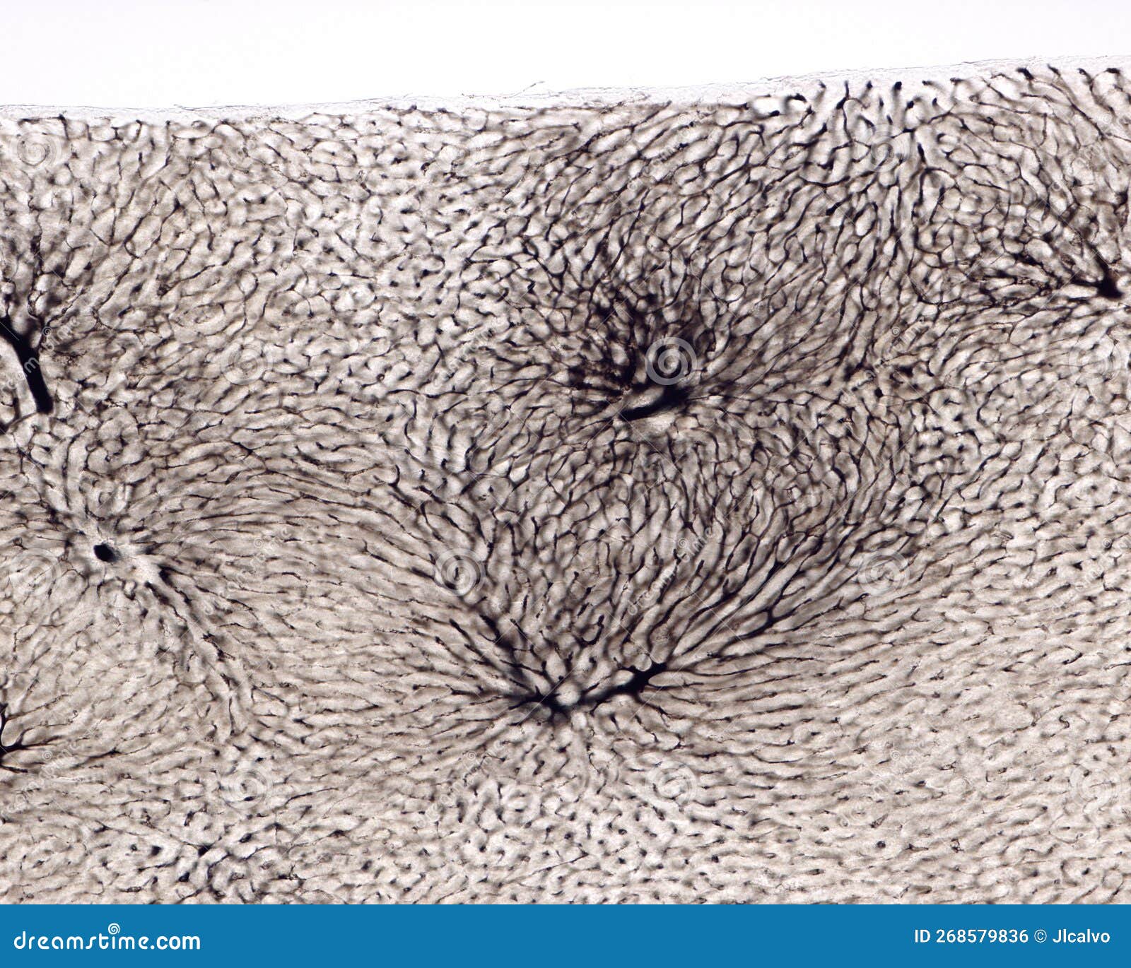 Liver. Blood vessels stock photo. Image of sinusoid - 268579836