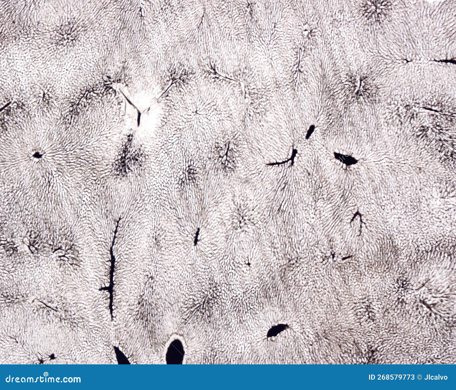 Liver. Blood vessels stock image. Image of microscopy - 268579773