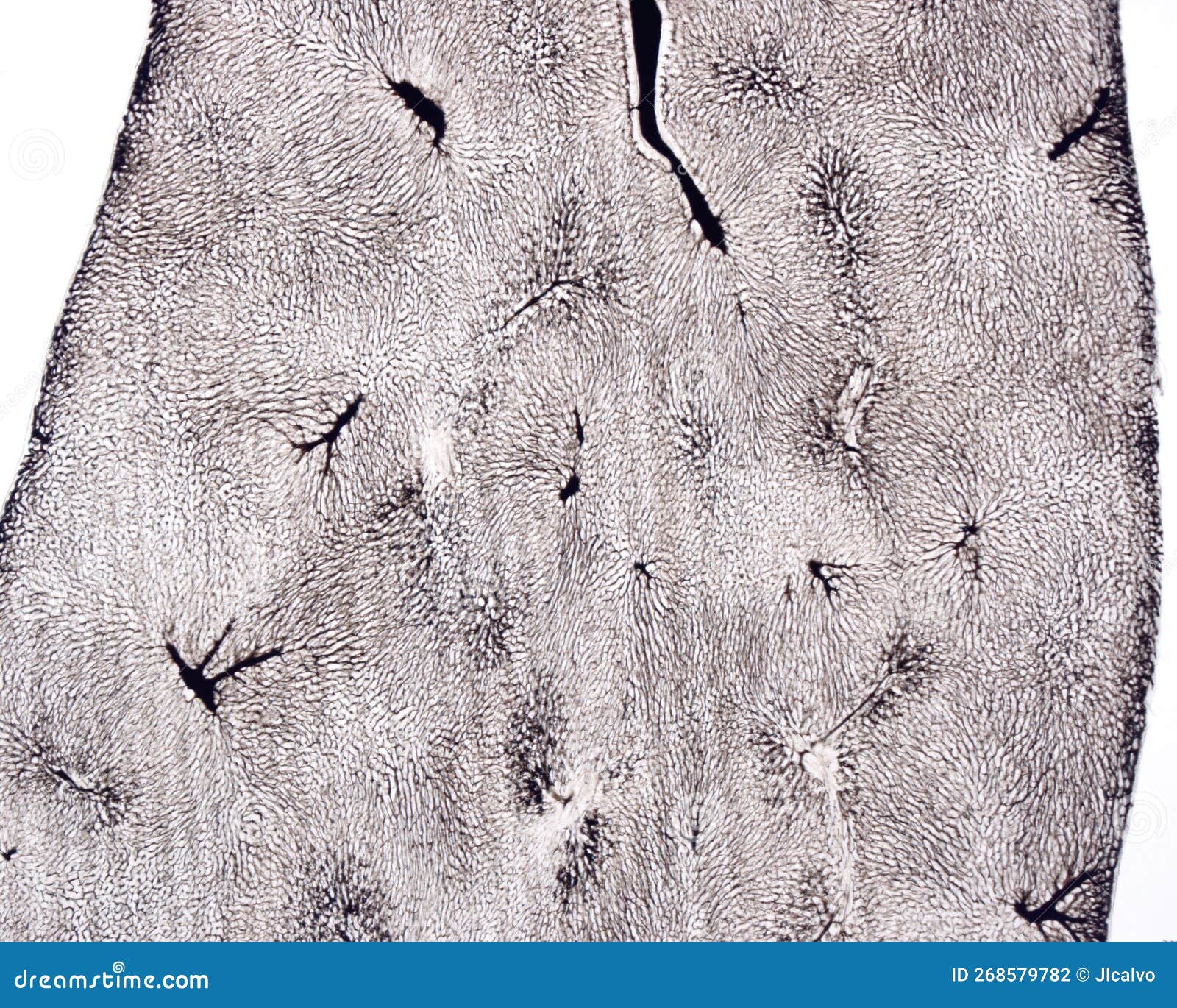 Liver. Blood vessels stock photo. Image of lobule, central - 268579782