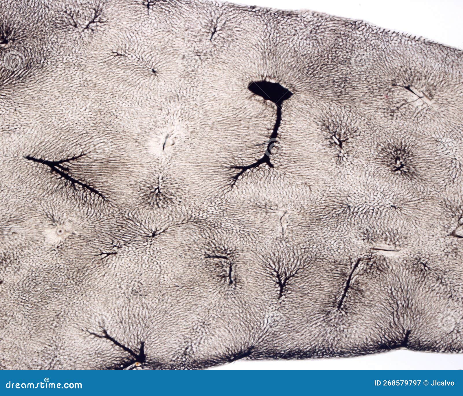 Liver. Blood vessels stock image. Image of microvasculature - 268579797