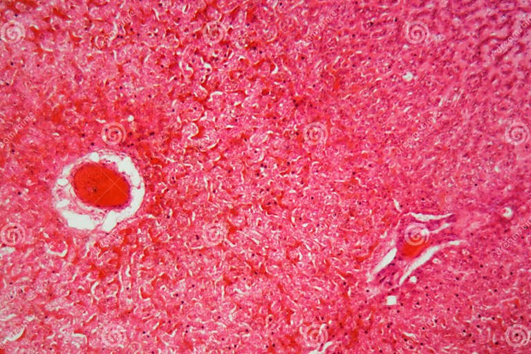 Liver Cells Under the Microscope Stock Image - Image of biology ...