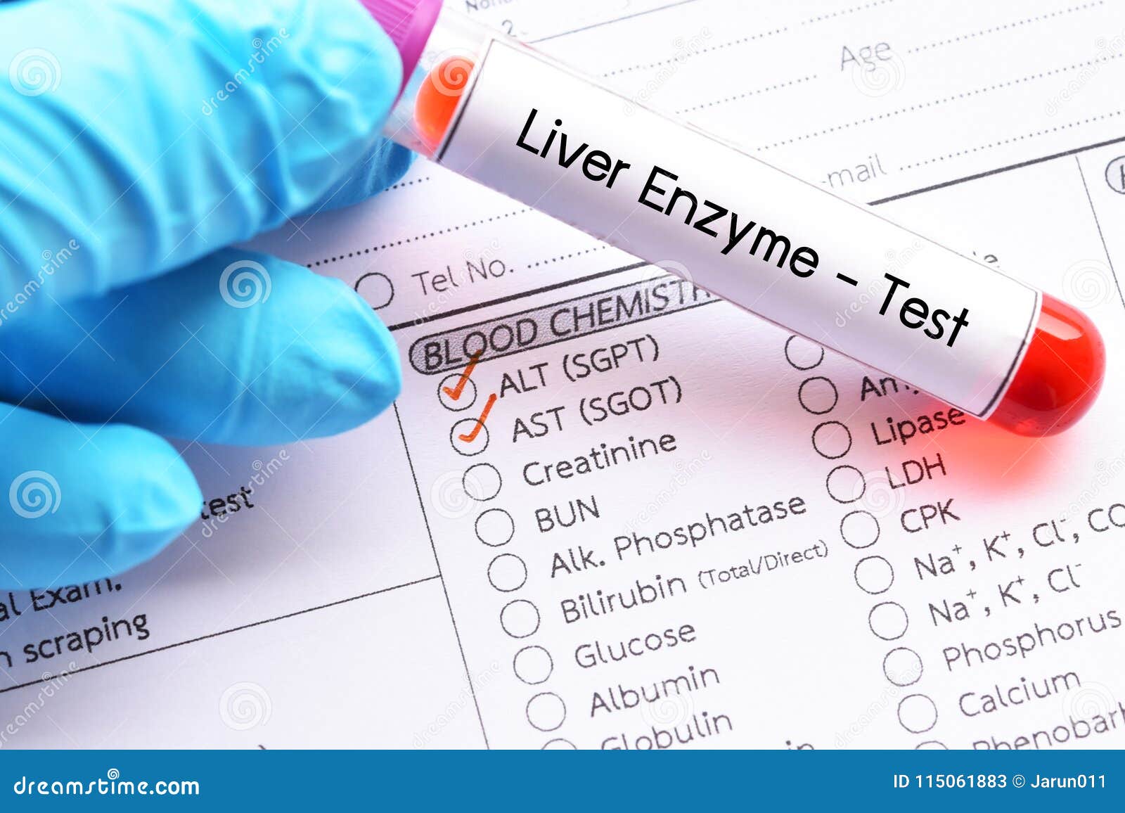 Liver enzyme test stock image. Image of medical, enzyme - 115061883
