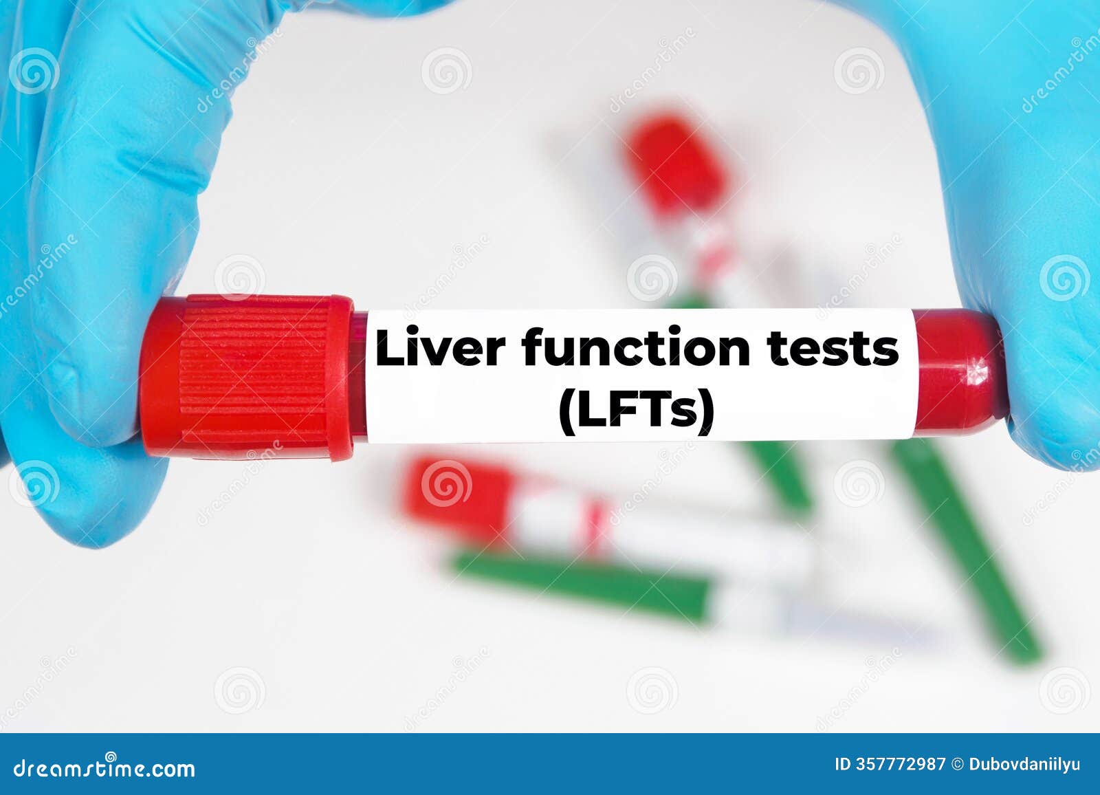 Liver Function Test Stock Image | CartoonDealer.com #103330531