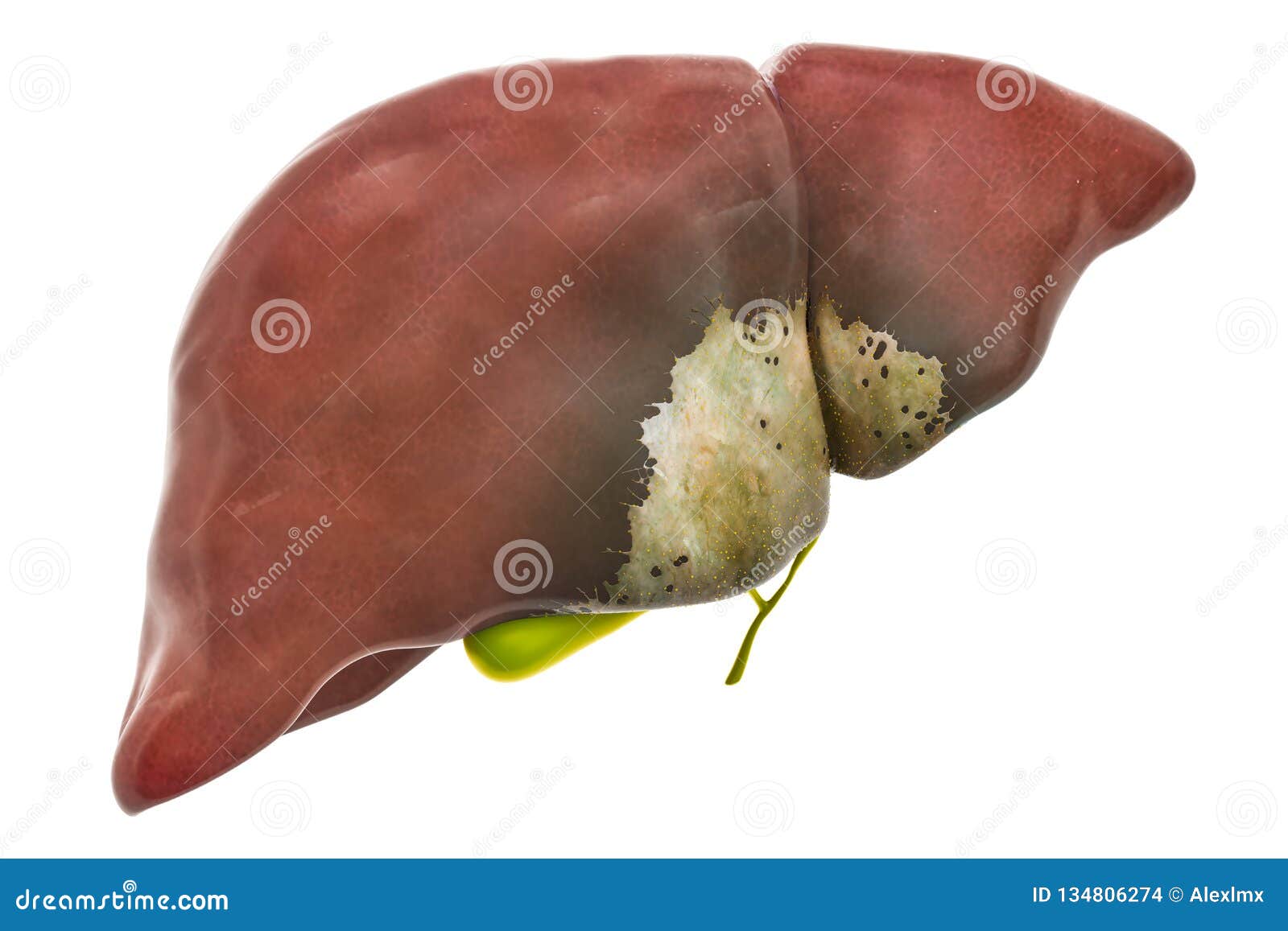 Liver Gallbladder Background Stock Illustrations – 2,989 Liver ...