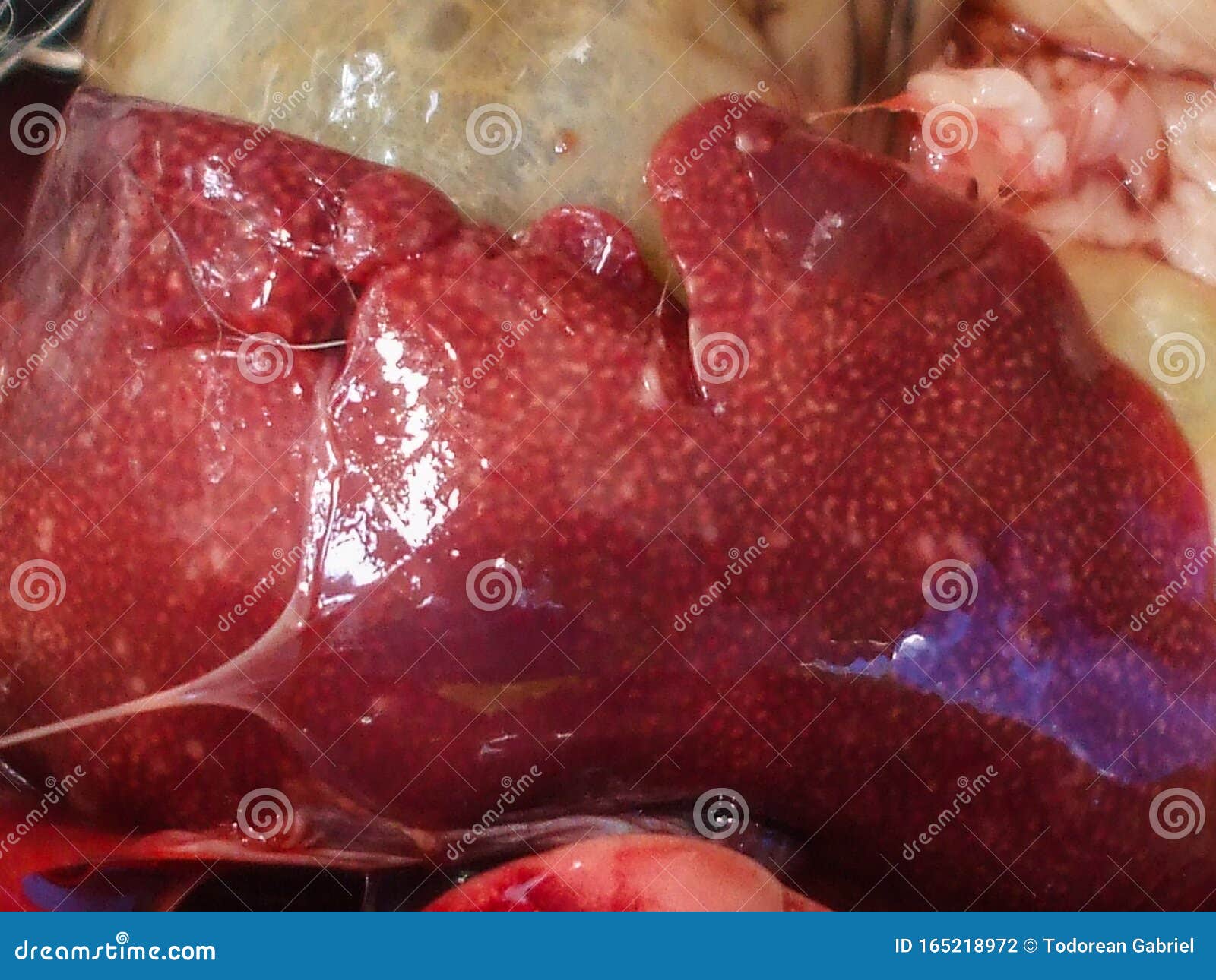 The Liver of a Rabbit with Coccidia Infection, at the Necropsy Stock ...