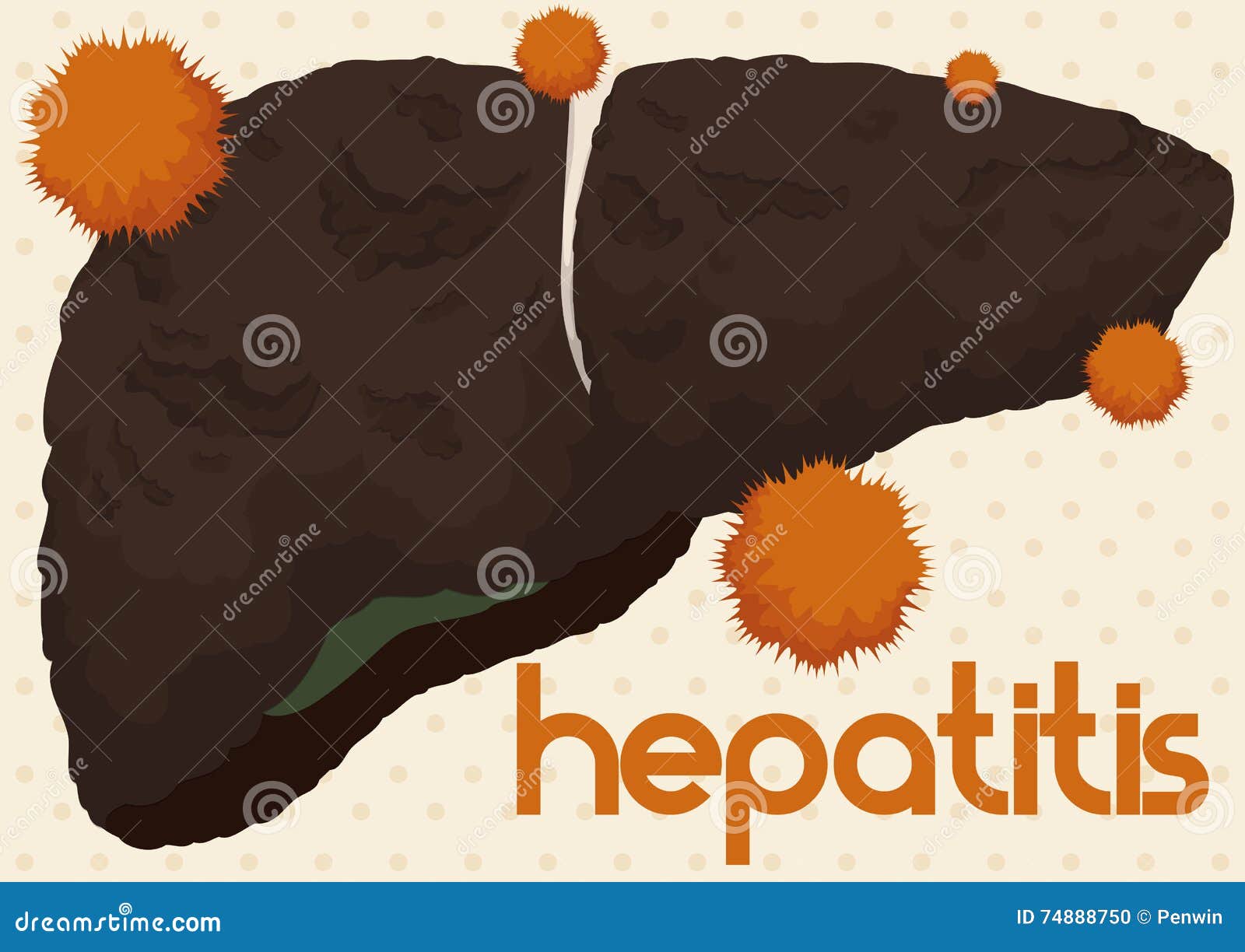 Liver Under Attack by Hepatitis Virus, Vector Illustration Stock Vector ...