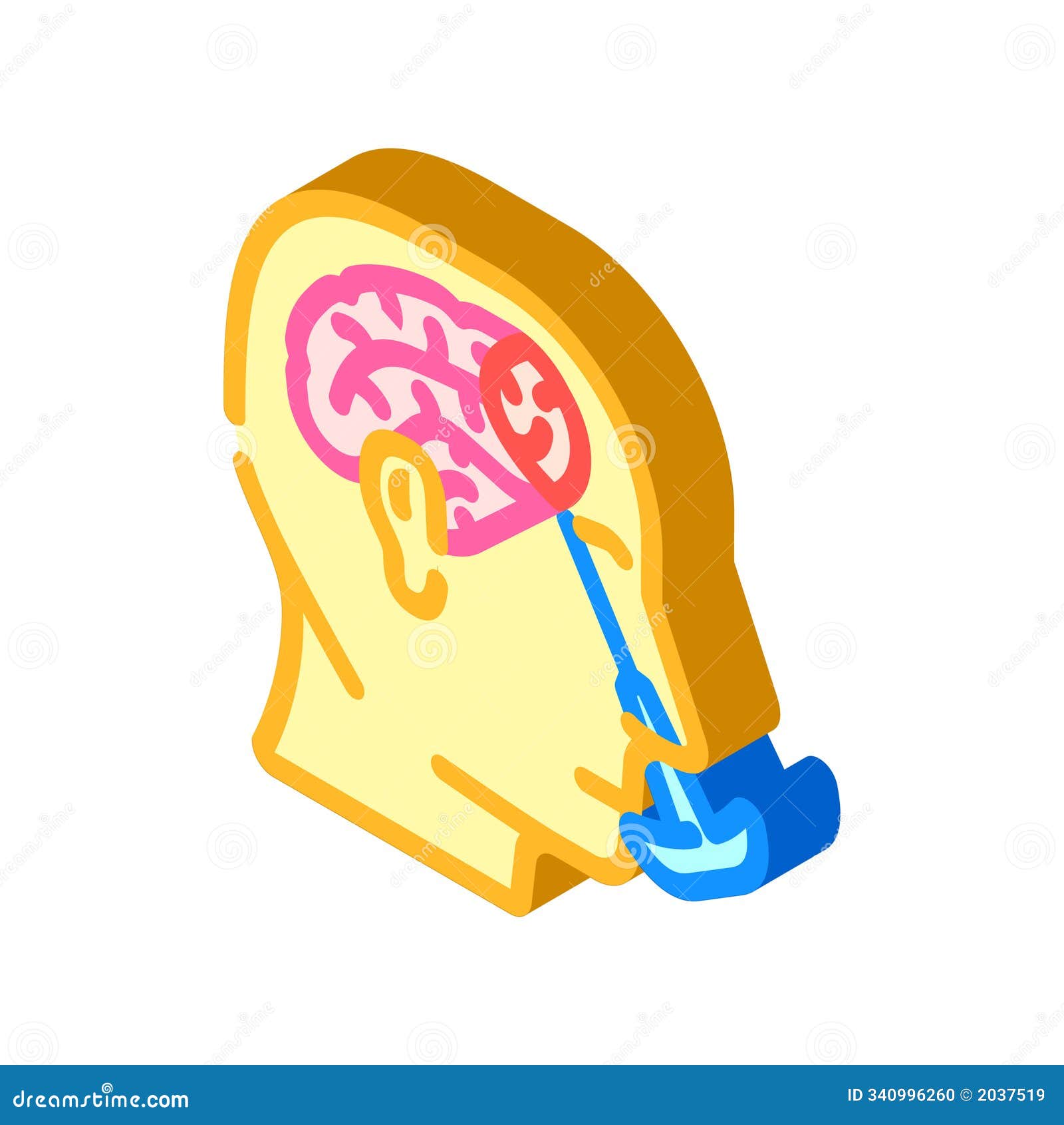 Lobotomy Surgery Isometric Icon Vector Illustration Stock Illustration ...