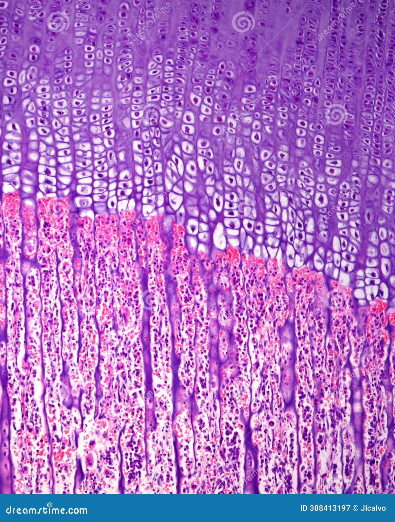 Small Intestine. Paneth Cells Stock Image - Image of defensin ...