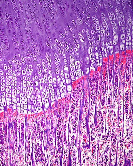 Small Intestine. Paneth Cells Stock Photo - Image of histology ...