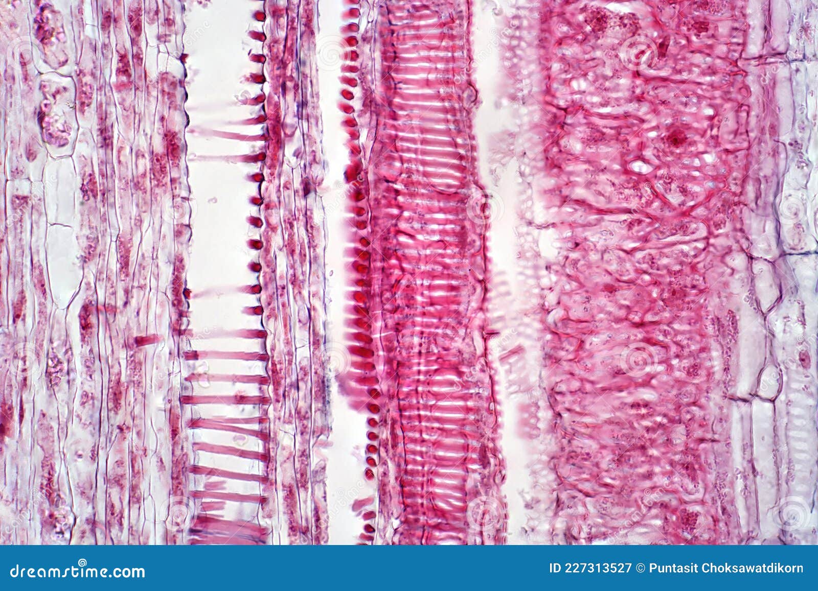 Long Section Plant Vascular Tissue Under the Light Microscope View ...
