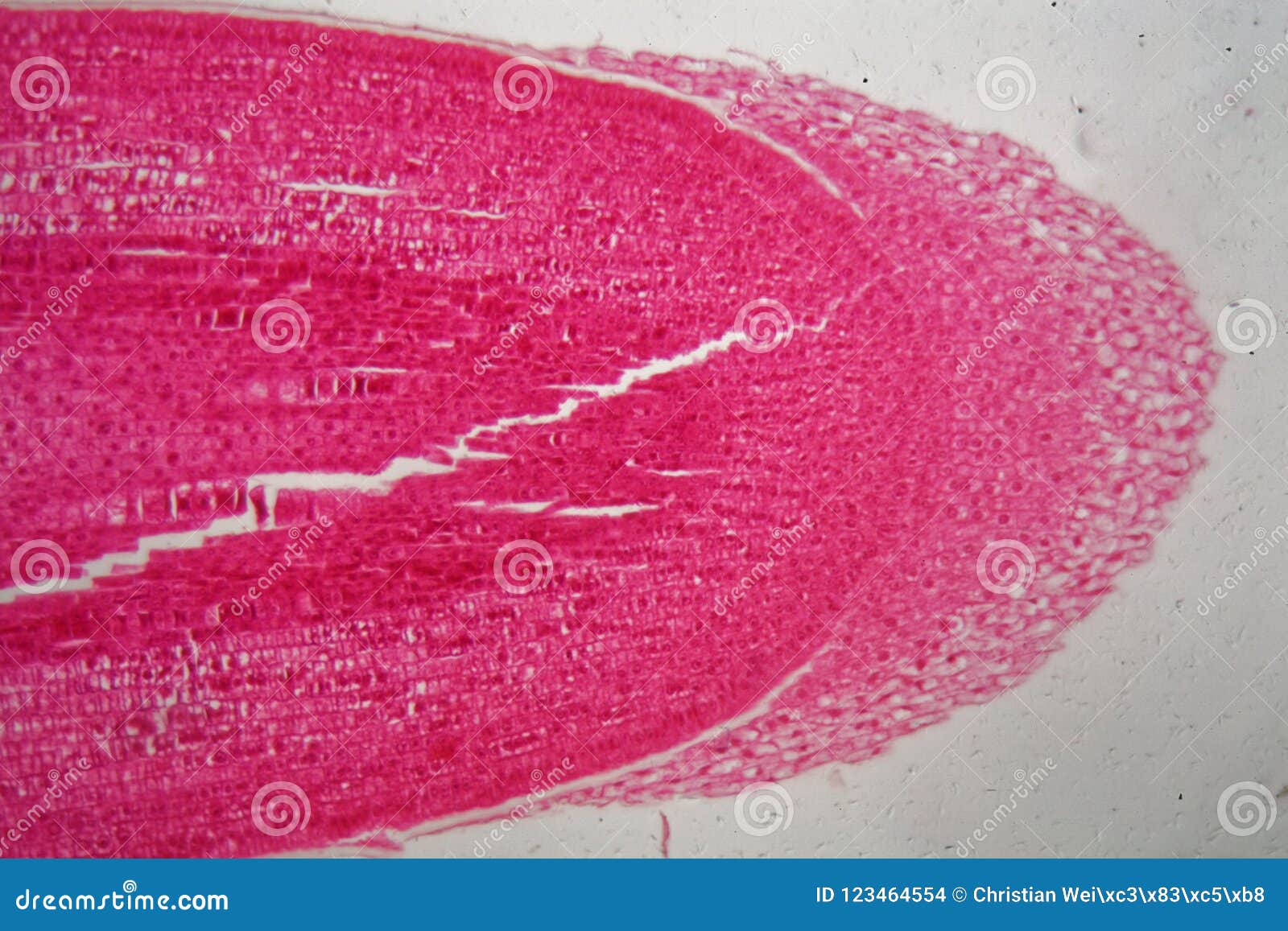 Zea Root Tip, Maize Plant Root, Longitudinal Section, Light Micrograph ...