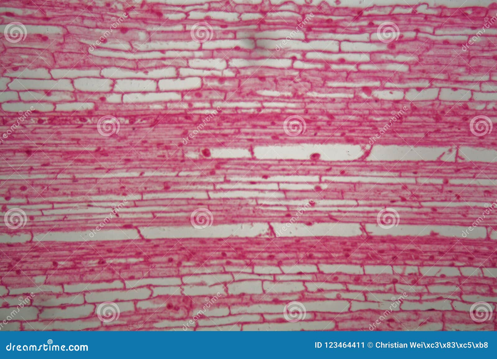 Zea Root Tip, Maize Plant Root, Longitudinal Section, Light Micrograph ...