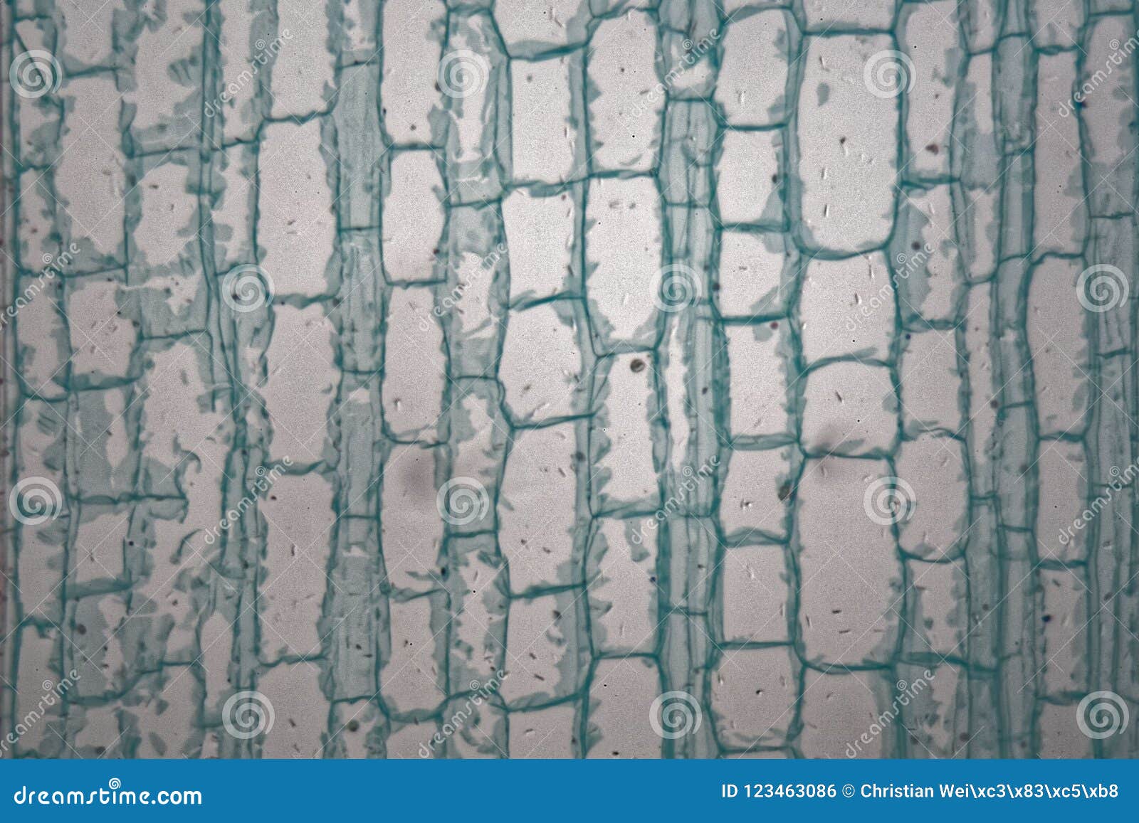 Zea Stem, Maize Stem, Zea Mays, Cross Section, 20X Light Micrograph ...