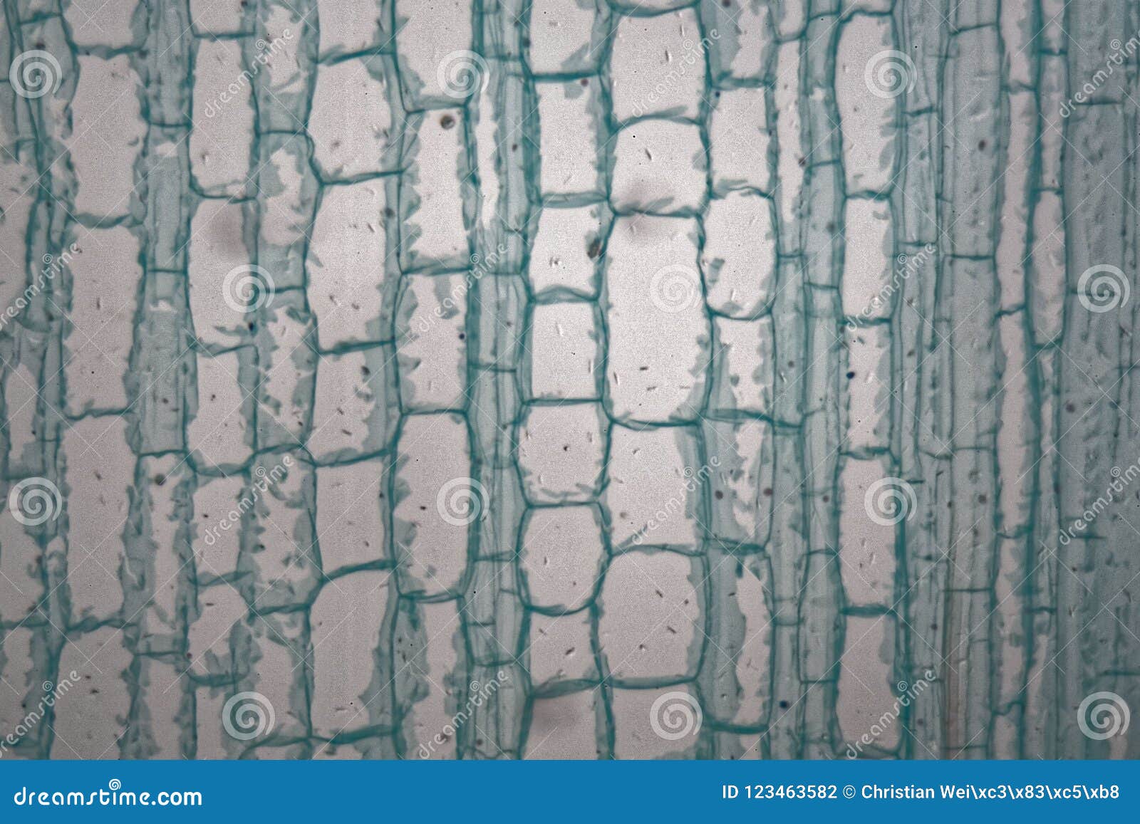 Zea Stem, Maize Stem, Zea Mays, Cross Section, 20X Light Micrograph ...