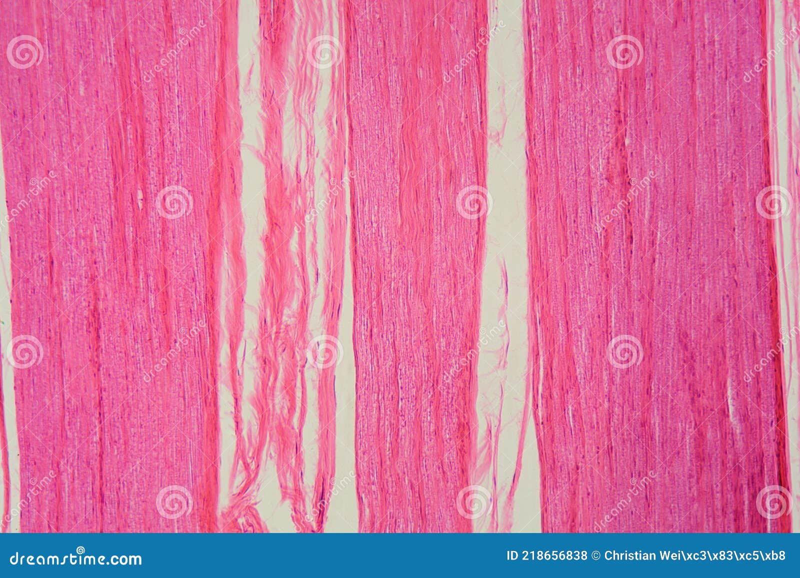 Longitudinal Section of Human Nerve Cells Under the Microscope Stock ...