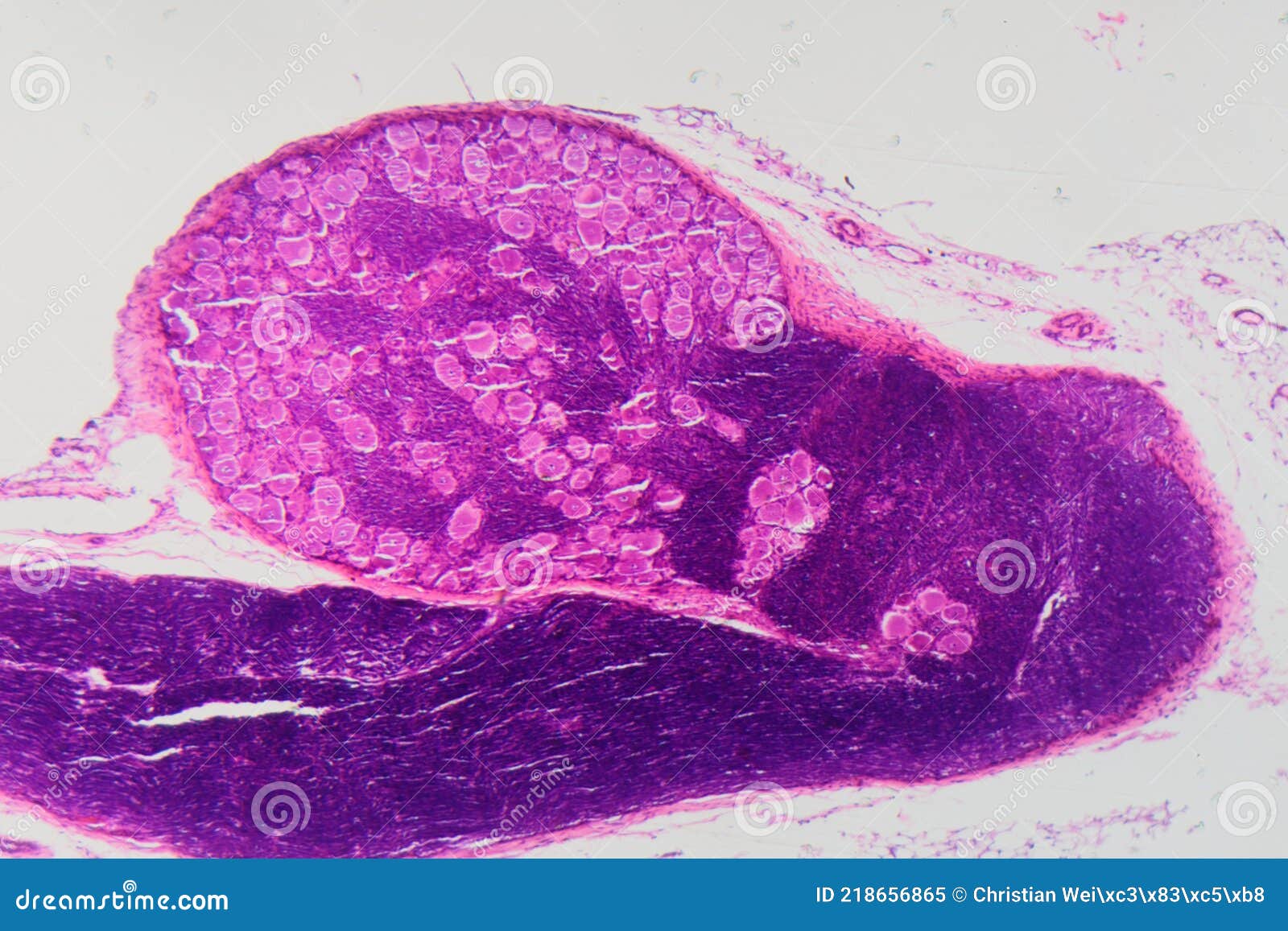Longitudinal Section Of Human Spinal Ganglion Cells Under The ...