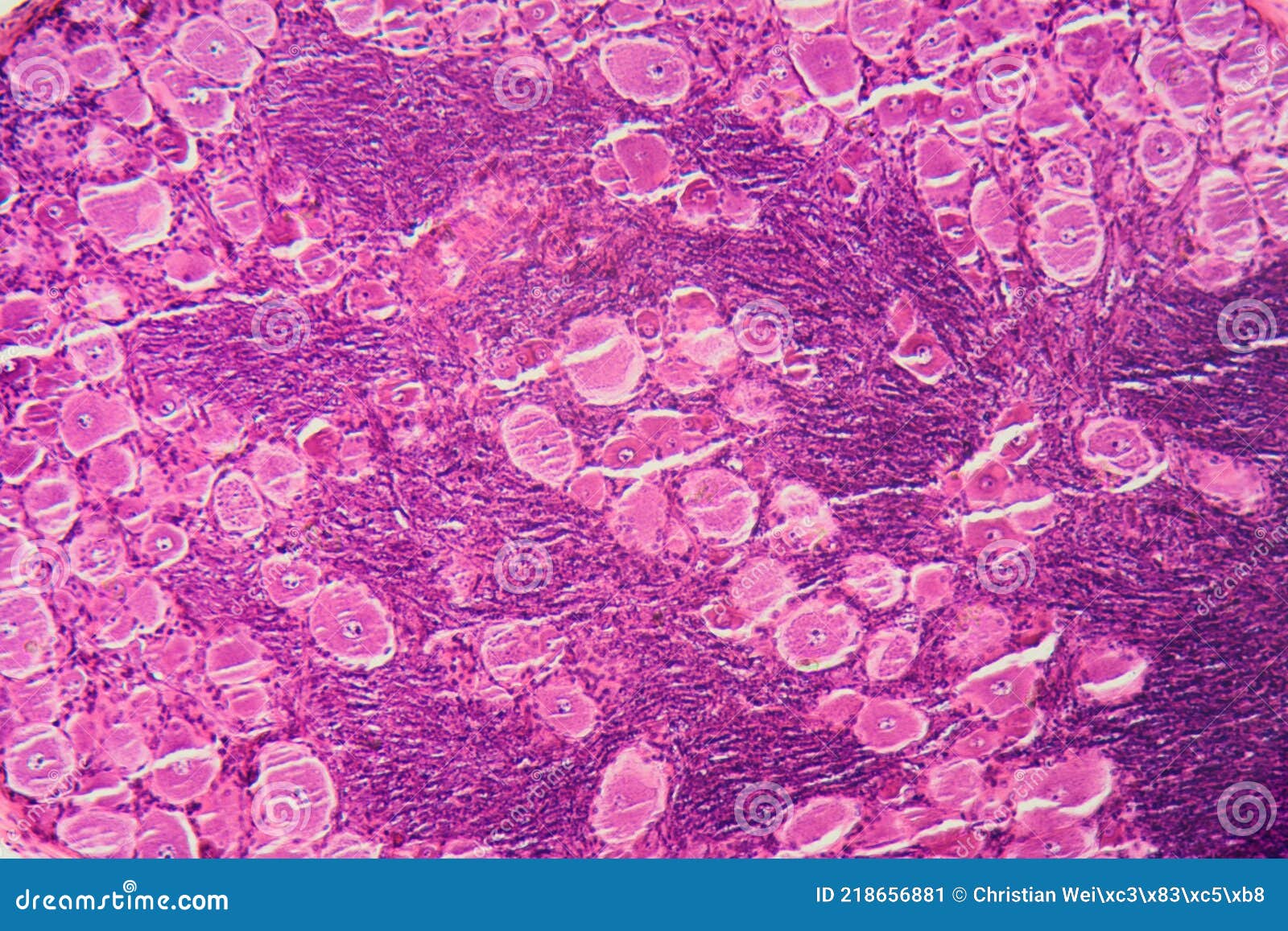 Longitudinal Section of Human Spinal Ganglion Cells Under the ...