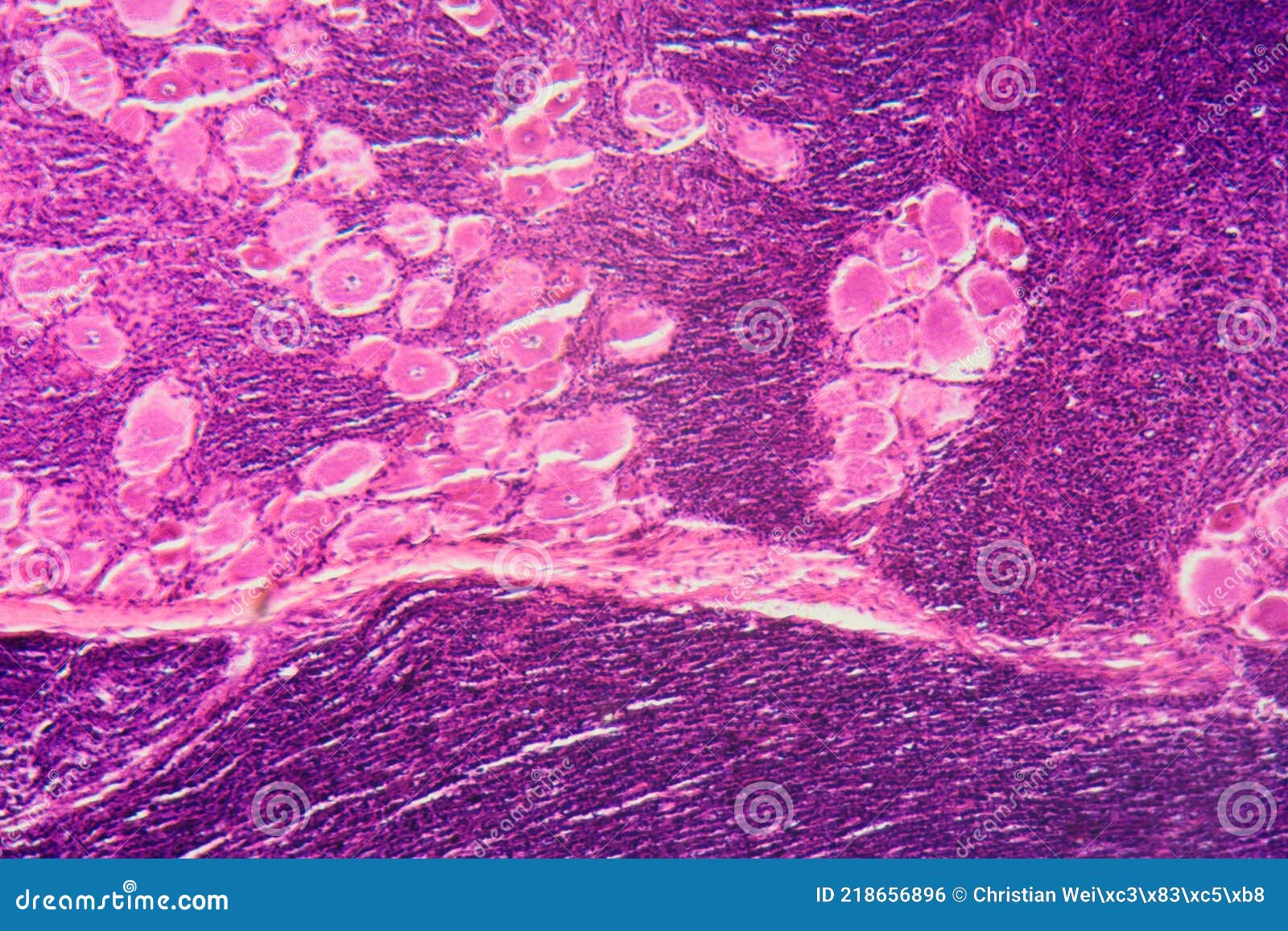 Human Dorsal Root Ganglion Cell Histology Stock Photos - Free & Royalty ...