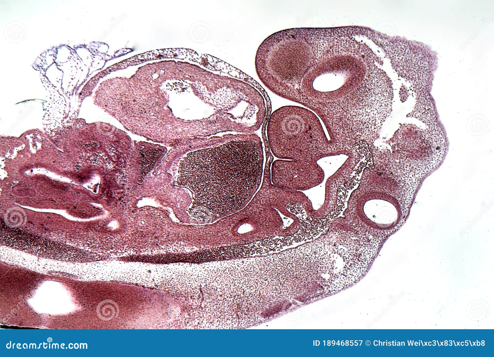 Section of a Porcine Embryo Under the Microscope Stock Image - Image of ...