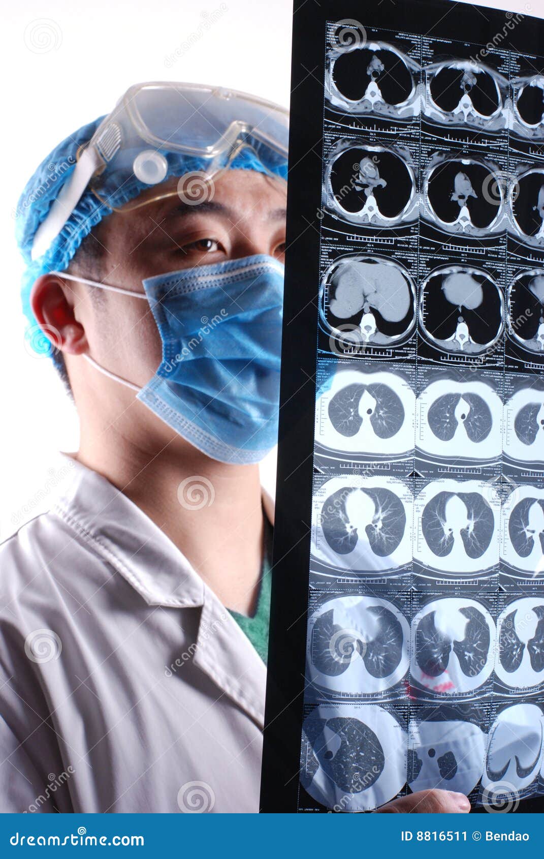 Looking at CT film stock image. Image of doctor, illness - 8816511