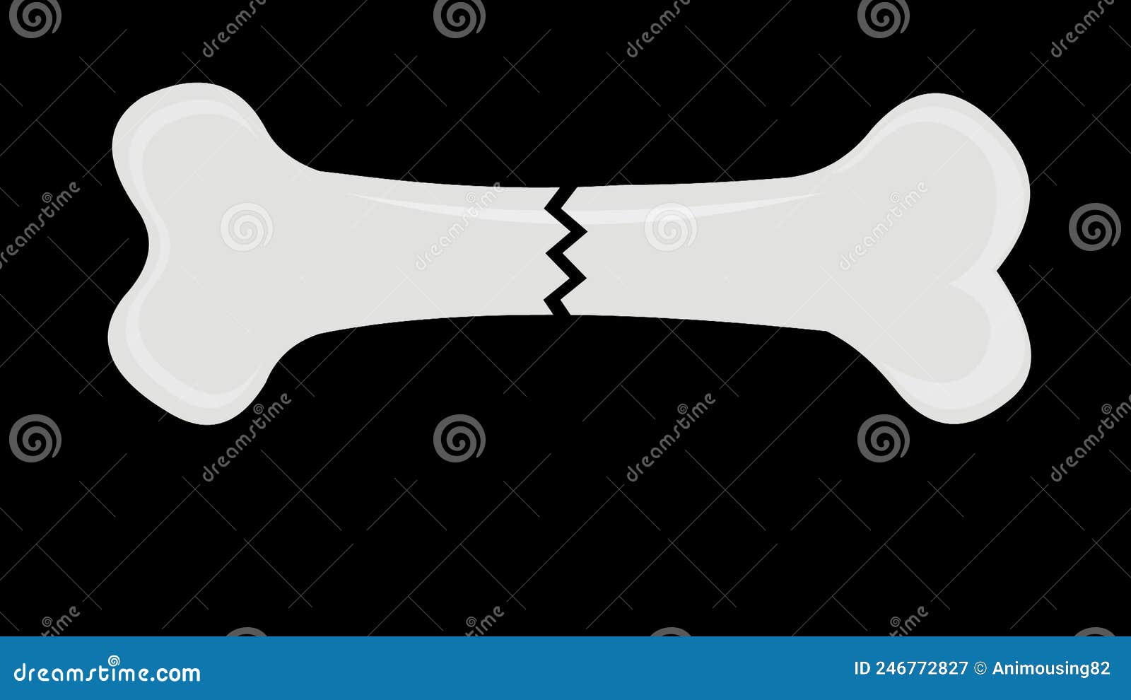 Loop Animation Bone Fracture Stock Video - Video of video, animation ...