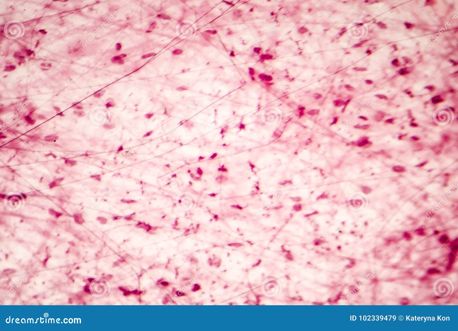 Los bindweefsel stock afbeelding. Image of microscopisch - 102339479