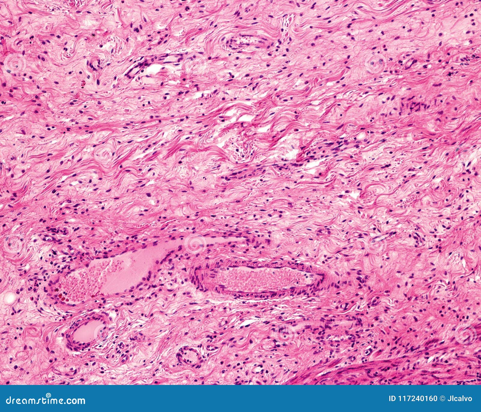 Los bindweefsel stock foto. Image of verbindings, schip - 117240160