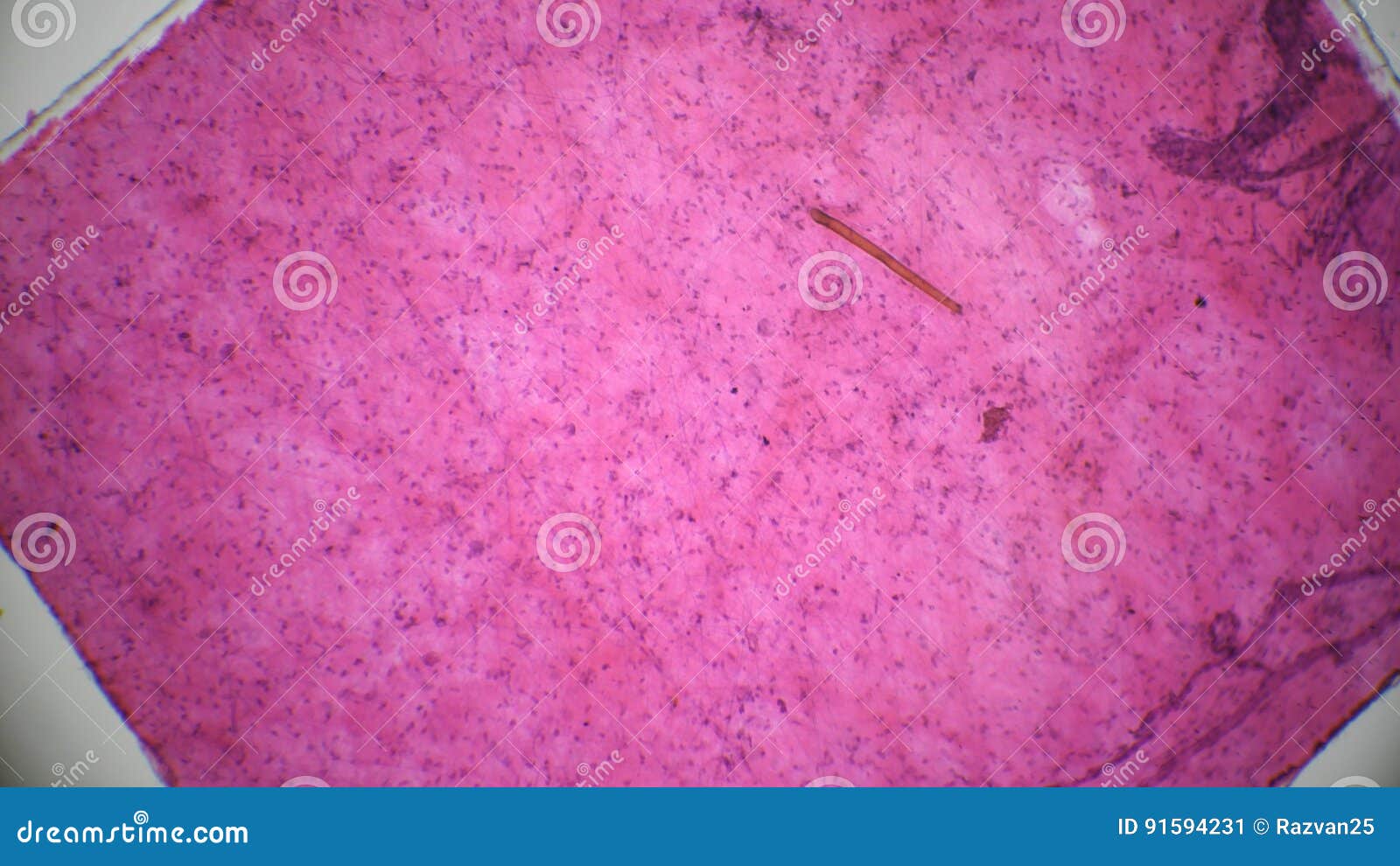 Los Bindweefsel, Rattit Onder De Microscoop Stock Afbeelding - Image of ...