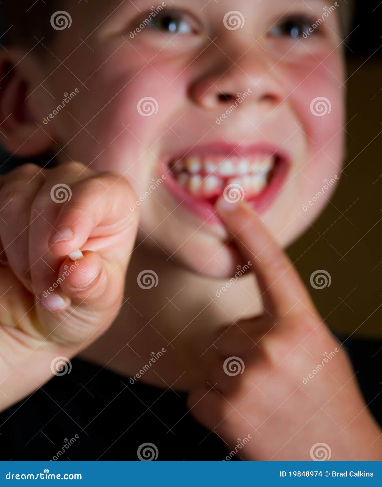 Losing first tooth stock photo. Image of baby, lost, child - 19848974
