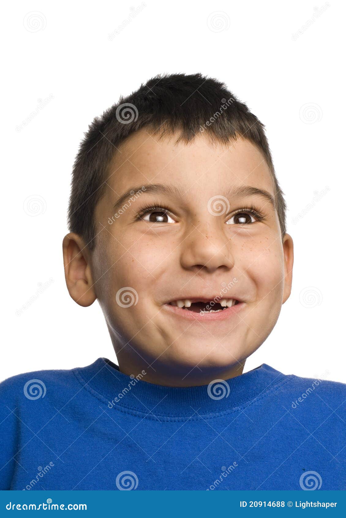 Lost two front teeth stock photo. Image of dentist, face - 20914688