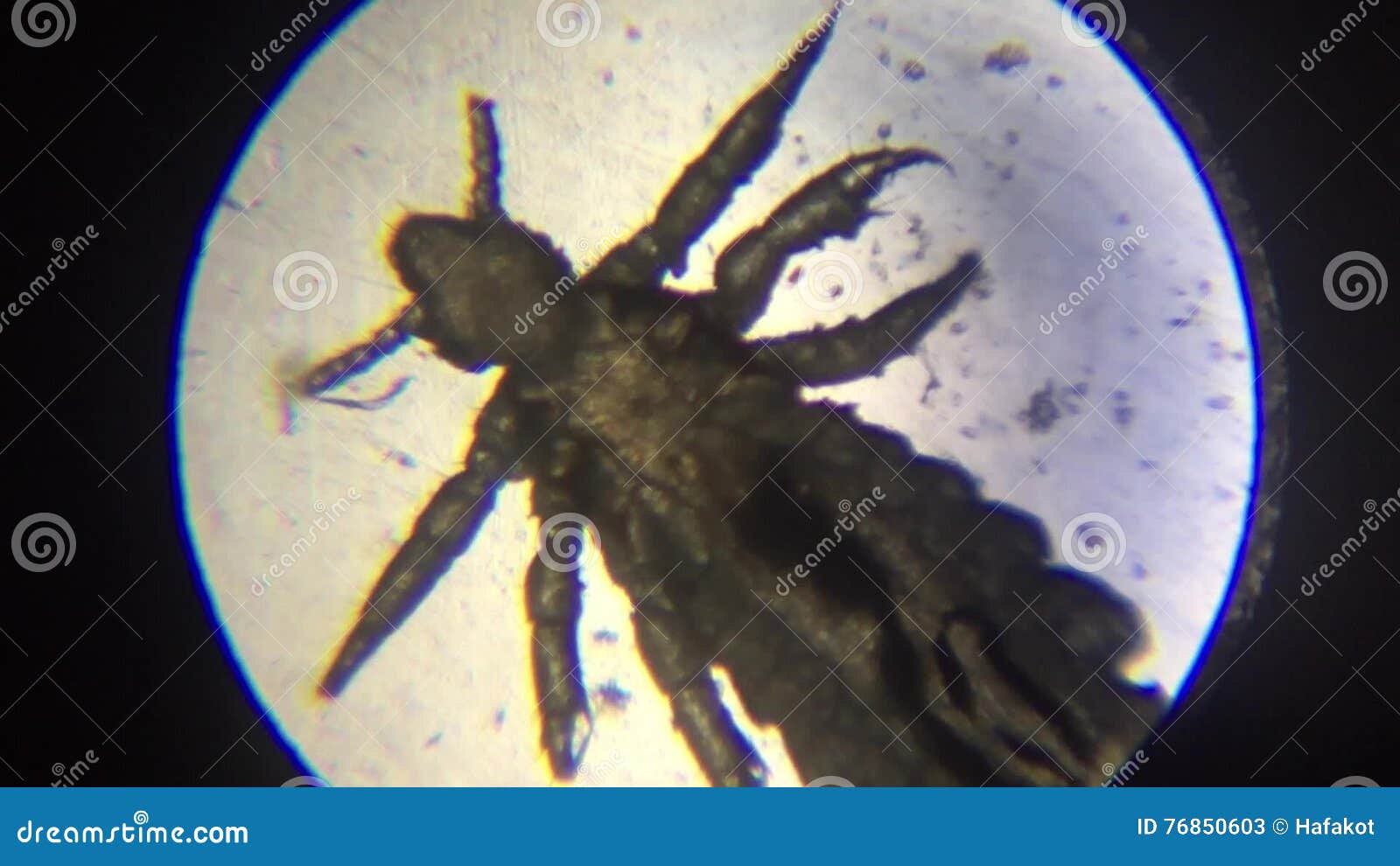 Louse Under Microscope View Stock Video - Video of medical, healthcare ...