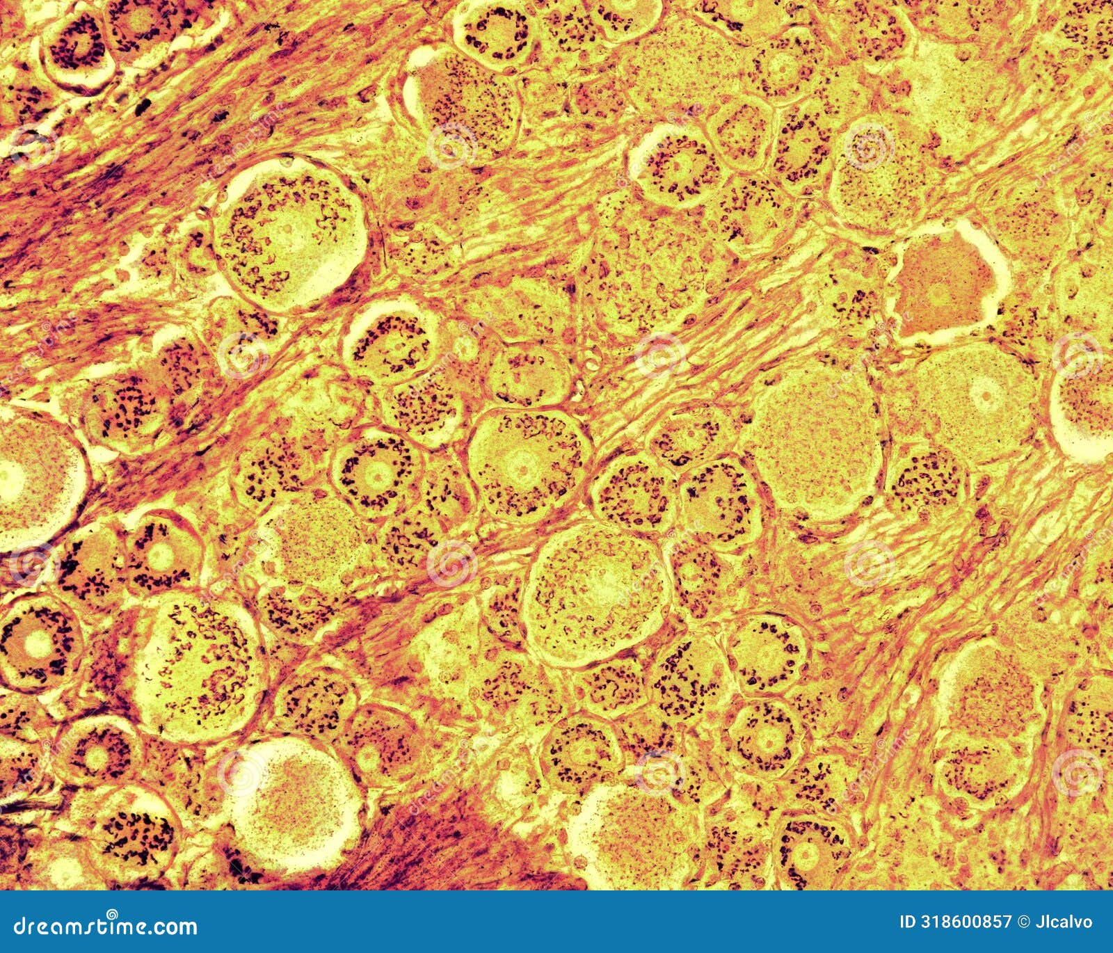 Dorsal Root Ganglion Neurons. Golgi Apparatus Stock Image - Image of ...