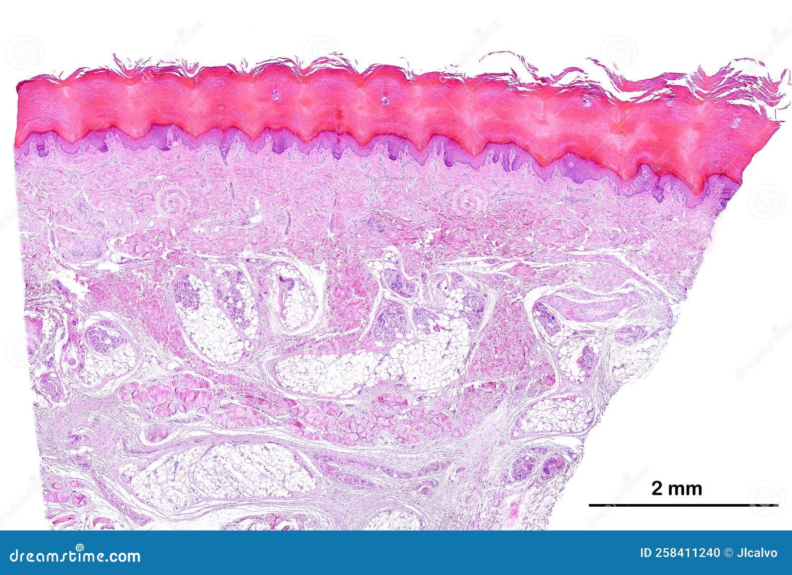 Stratified Squamous Keratinized