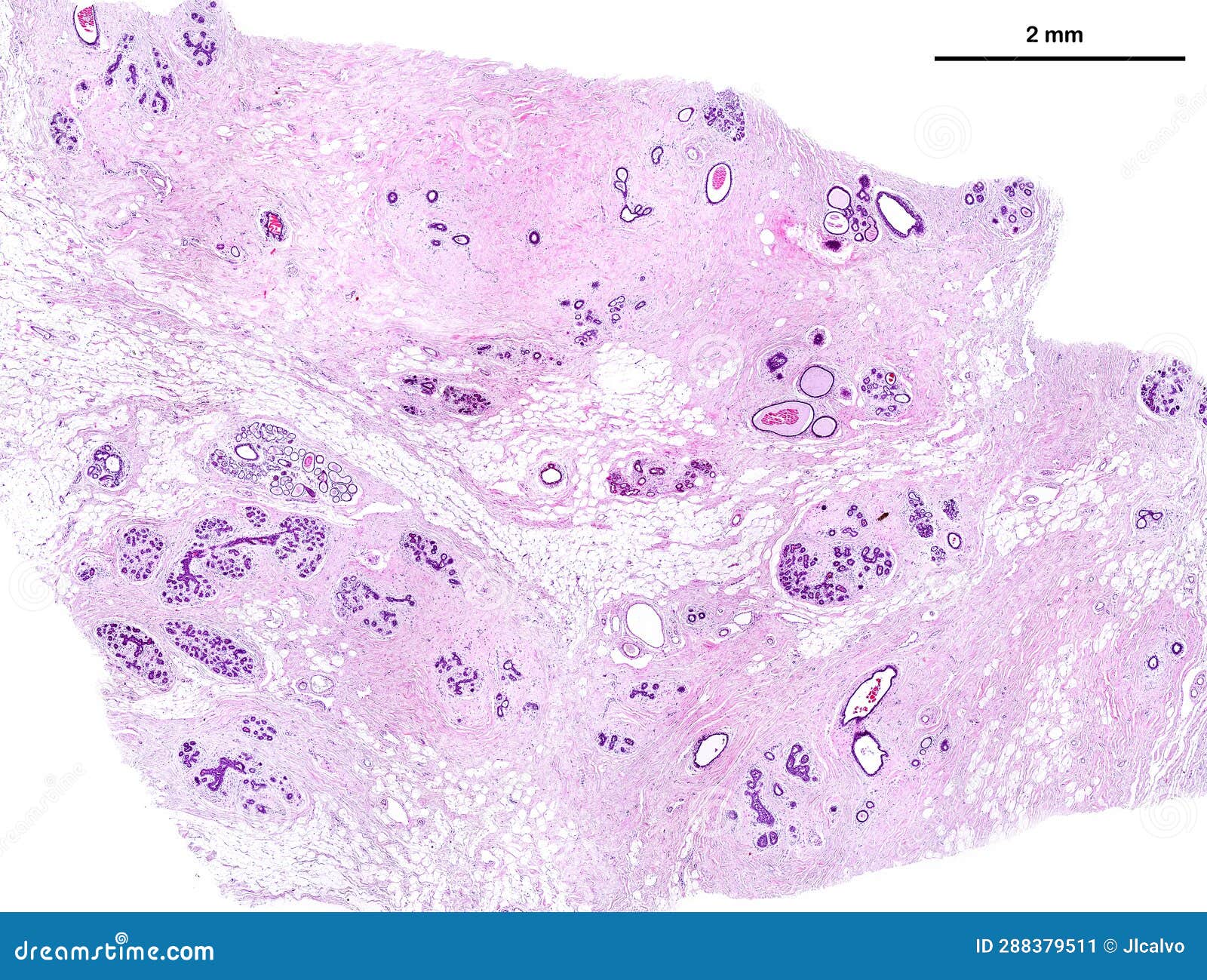 Human breast stock image. Image of hematoxylineosin - 288379511