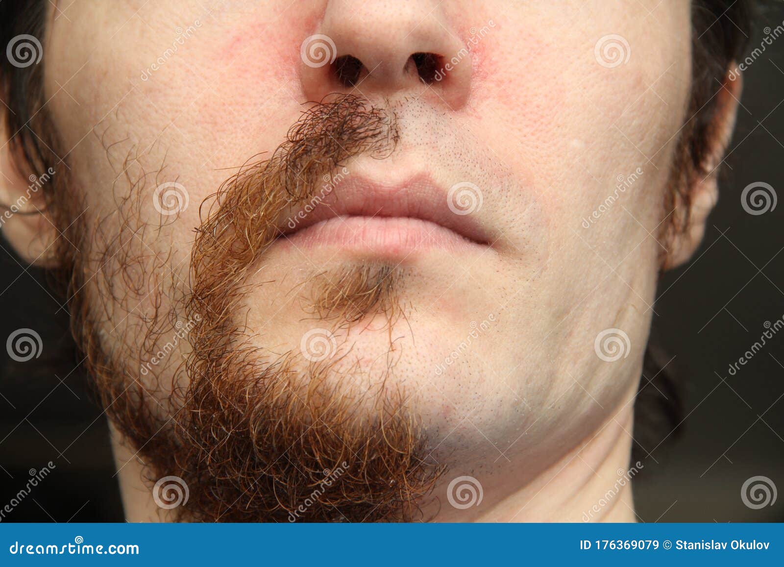 The Lower Part of the Face of a White Man. Half of the Face is Shaved ...