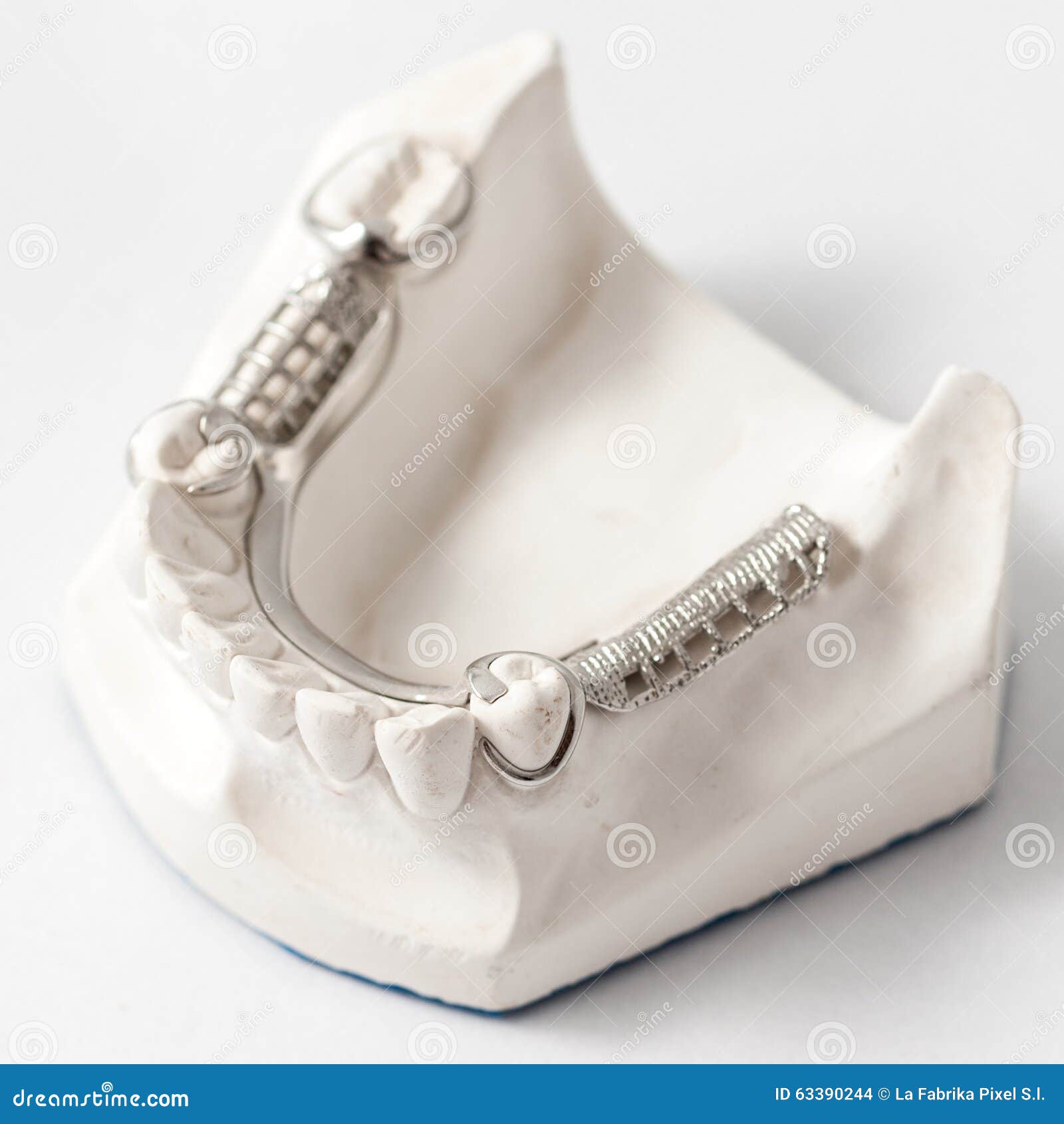Lower Partial Denture With Attachments Royalty-Free Stock Photo ...