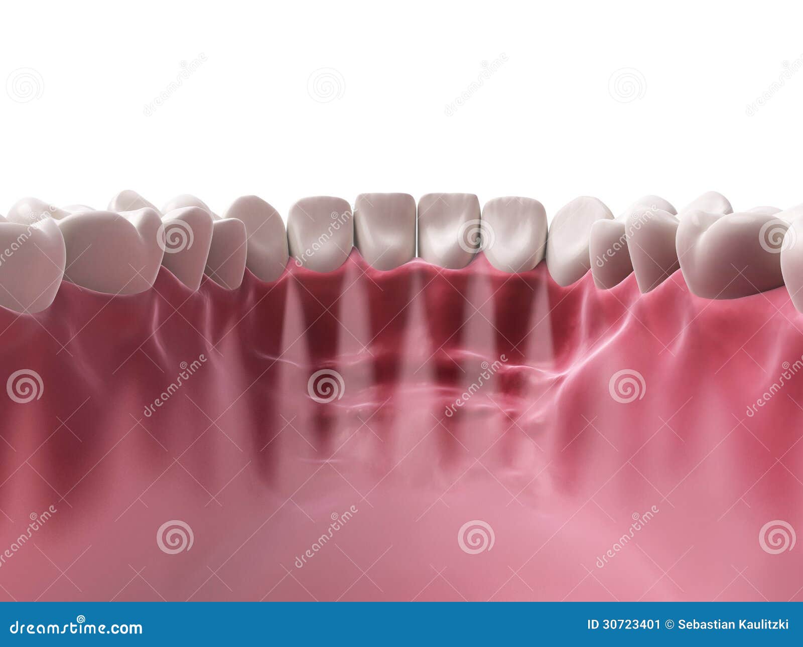 Lower teeth stock illustration. Illustration of clinic - 30723401