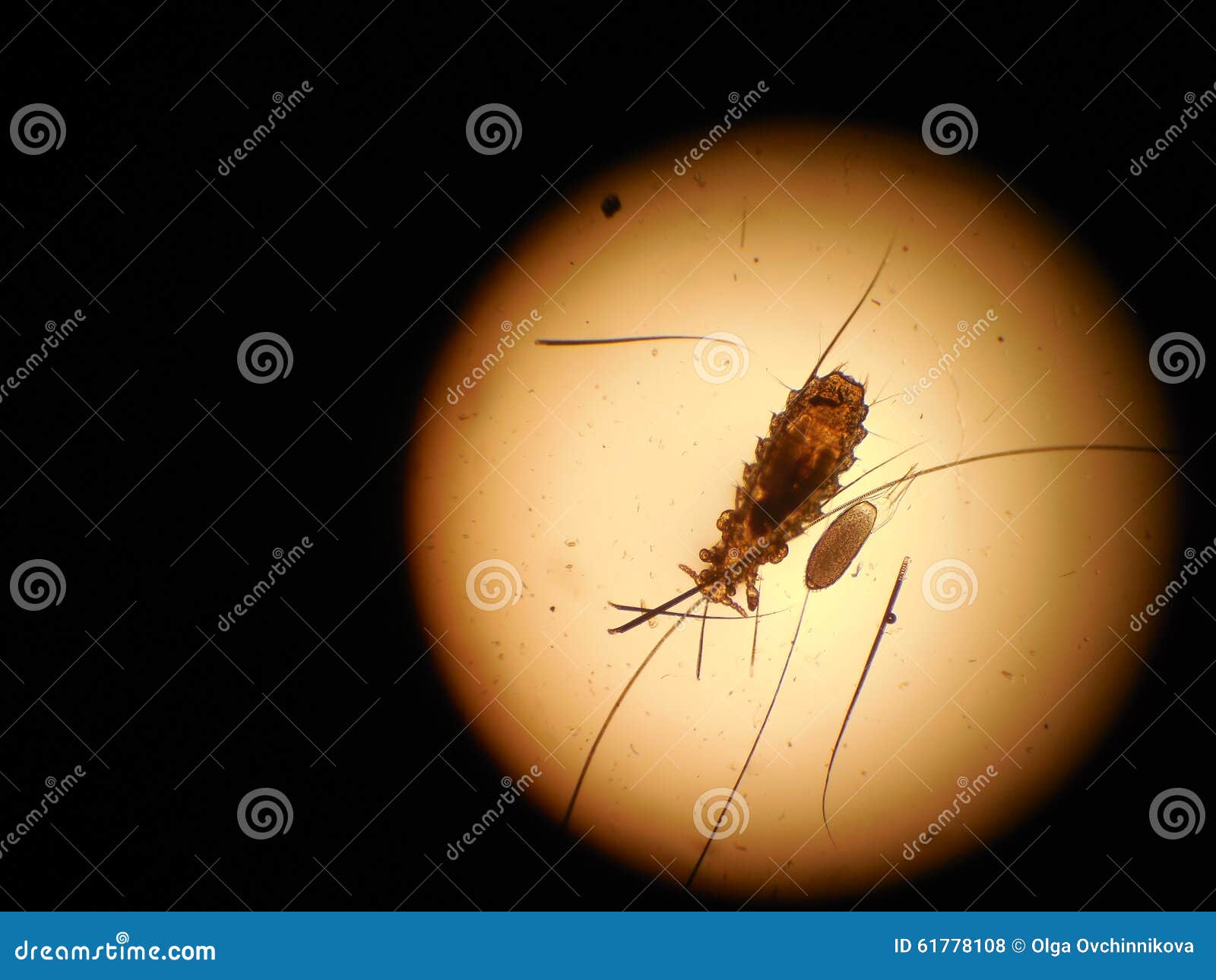 Luis En Eispinulosa Van Polyplax Stock Foto - Image of dermatoloog ...