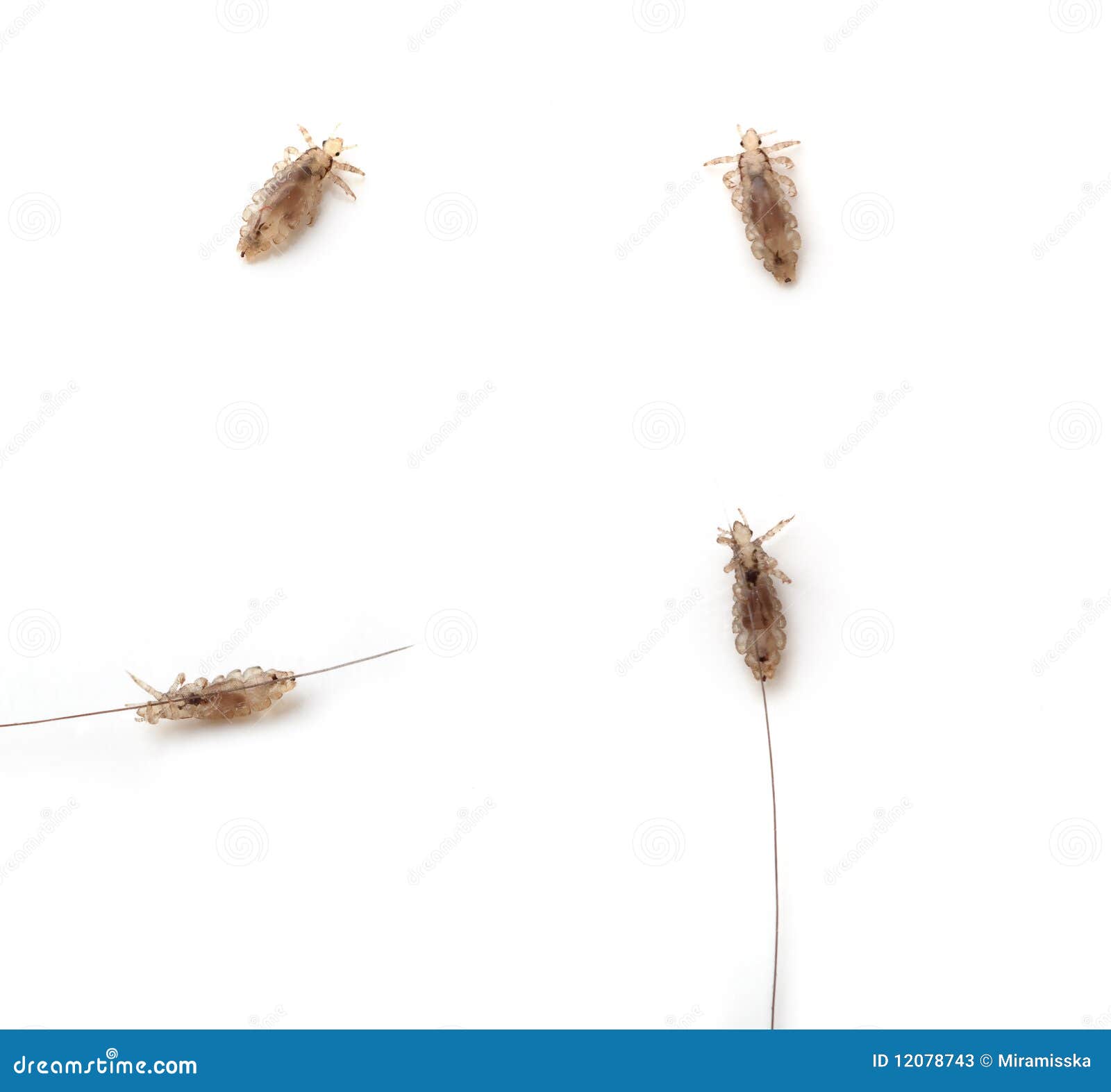 Luizen stock afbeelding. Image of neten, menselijk, ziekte - 12078743