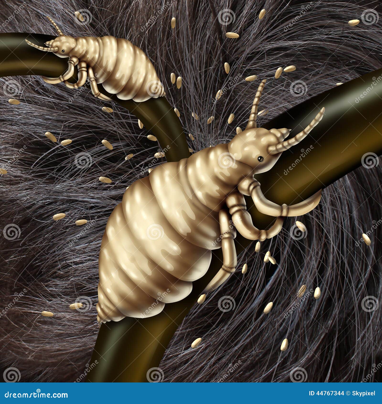 Luizen in Haar stock illustratie. Illustration of insecten - 44767344