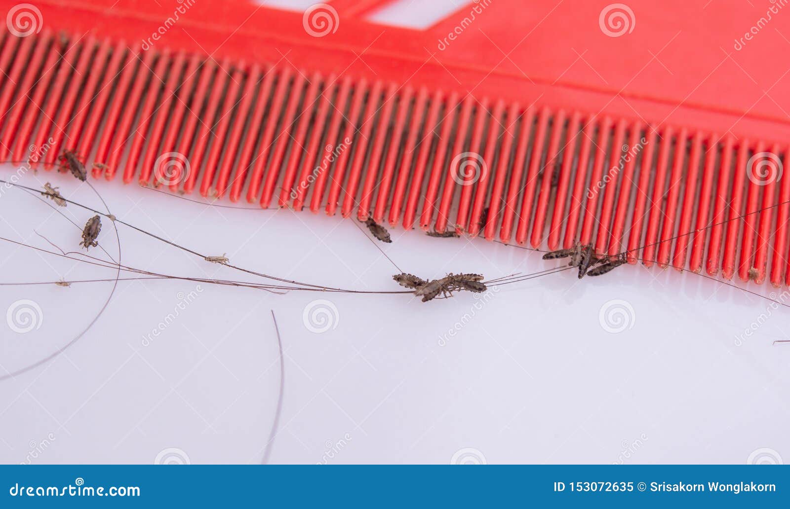 Luizen in haar en kam stock afbeelding. Image of fauna - 153072635