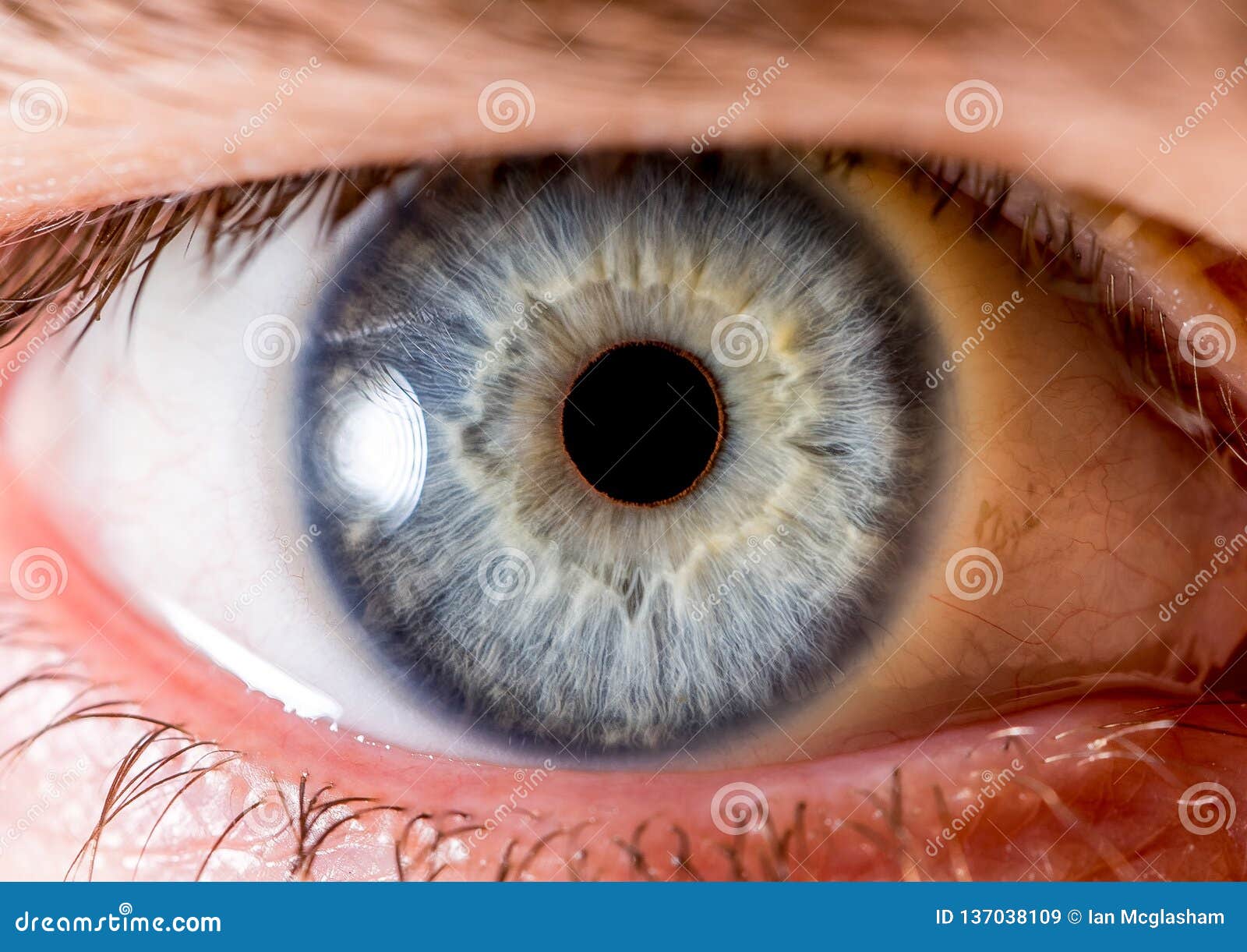 Close Up Eye. Close Up Iris. Very Close Macro Shot of an Eyeball. Pale ...
