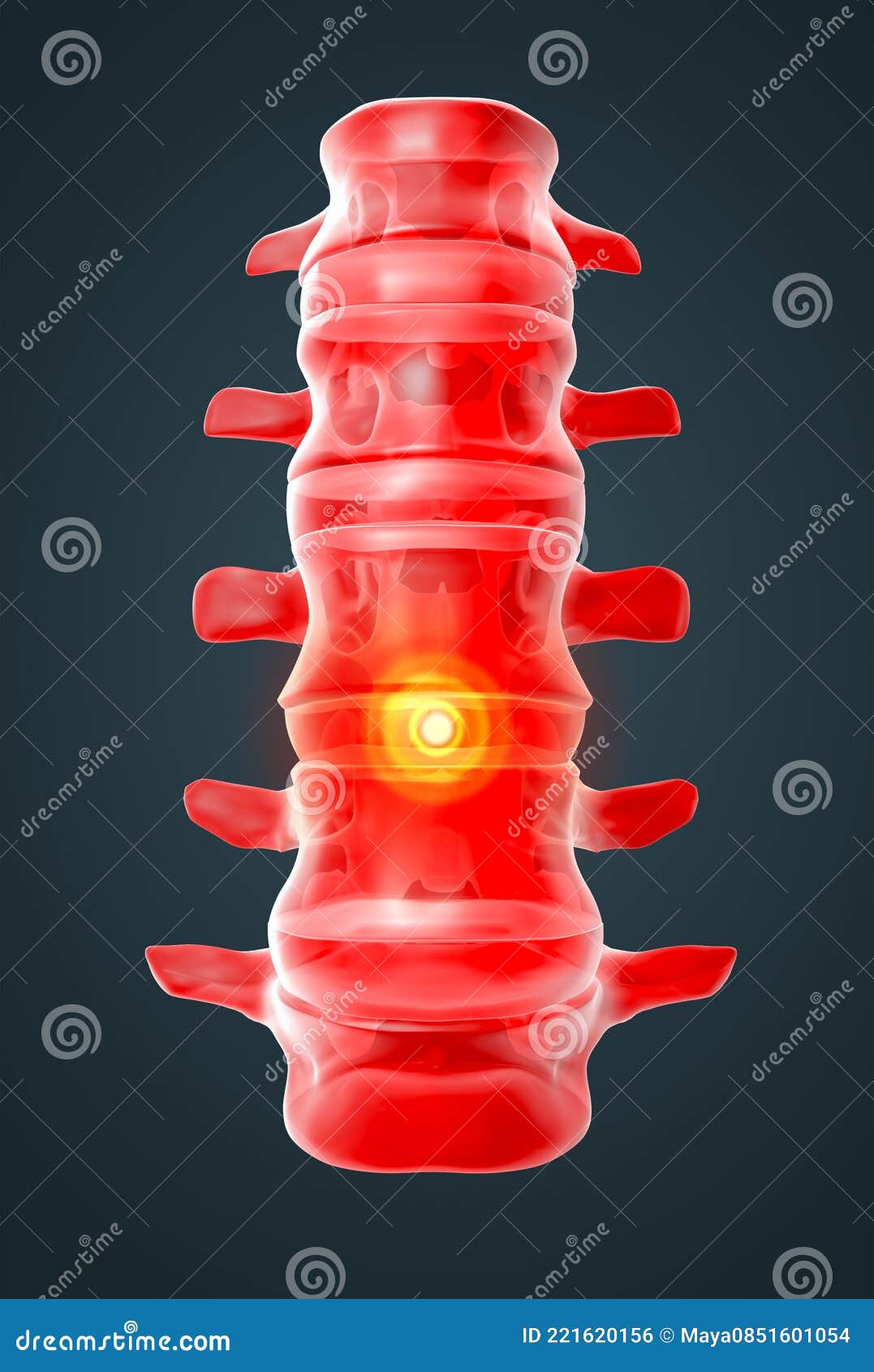 3D Rendering Illustration of Lumbar Stock Illustration - Illustration ...