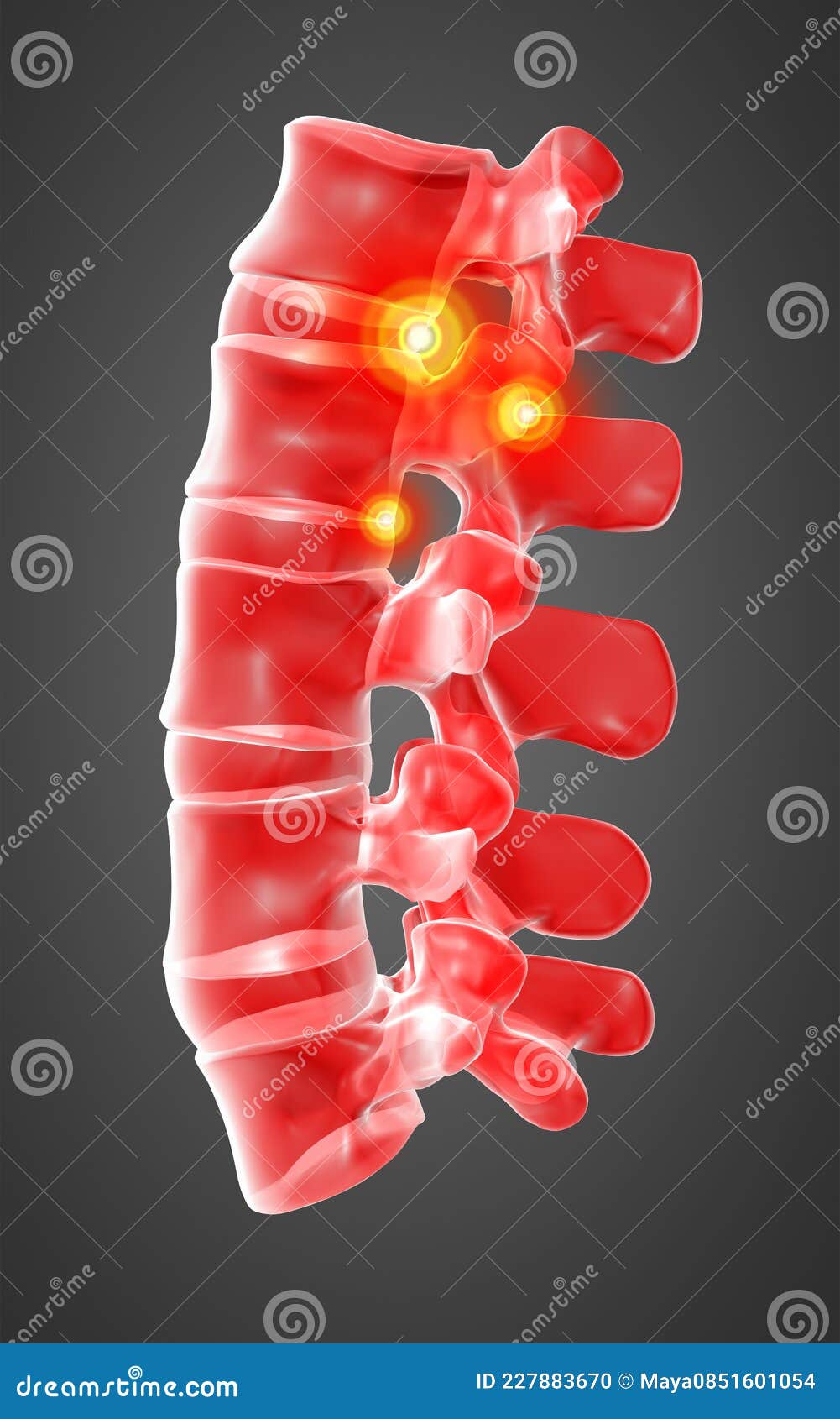 3D rendering of lumbar stock illustration. Illustration of back - 227883670