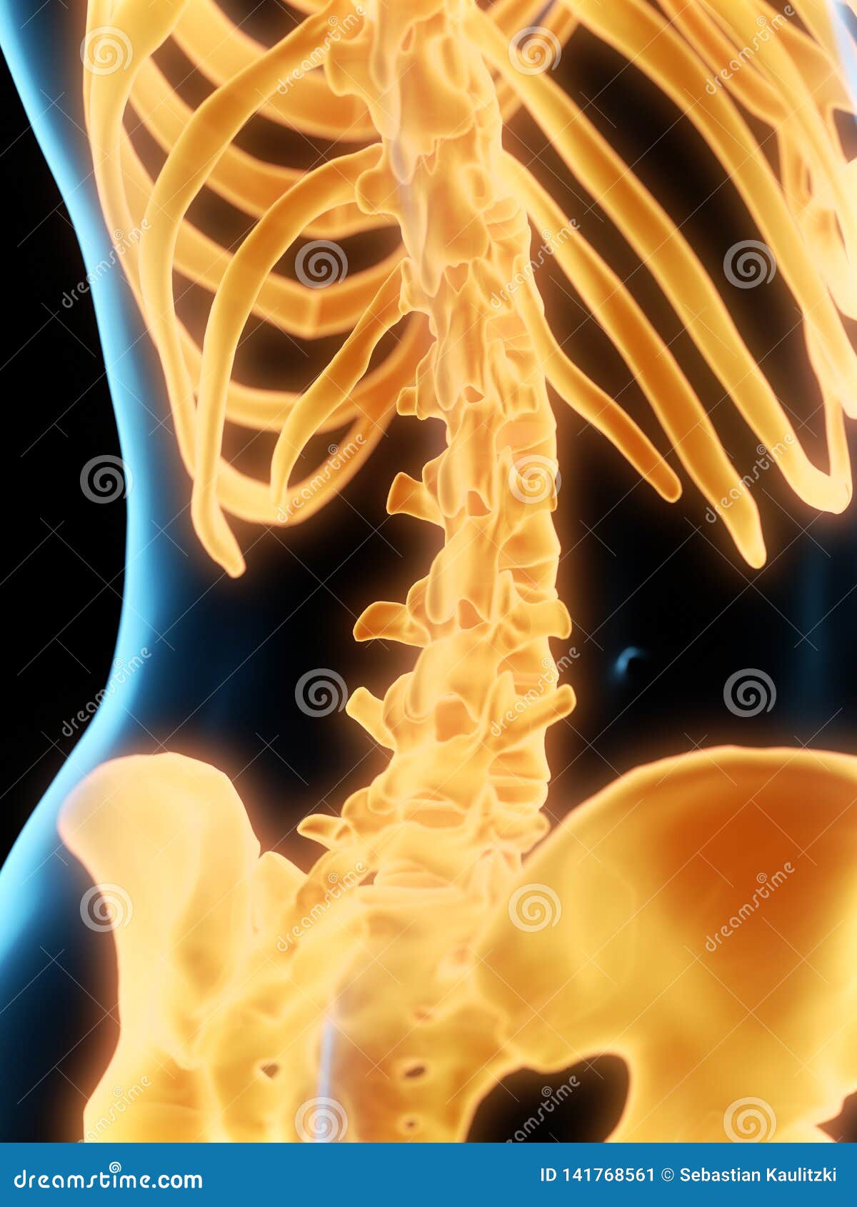 Arthrosis In The Lumbar Spine Royalty-Free Illustration | CartoonDealer ...